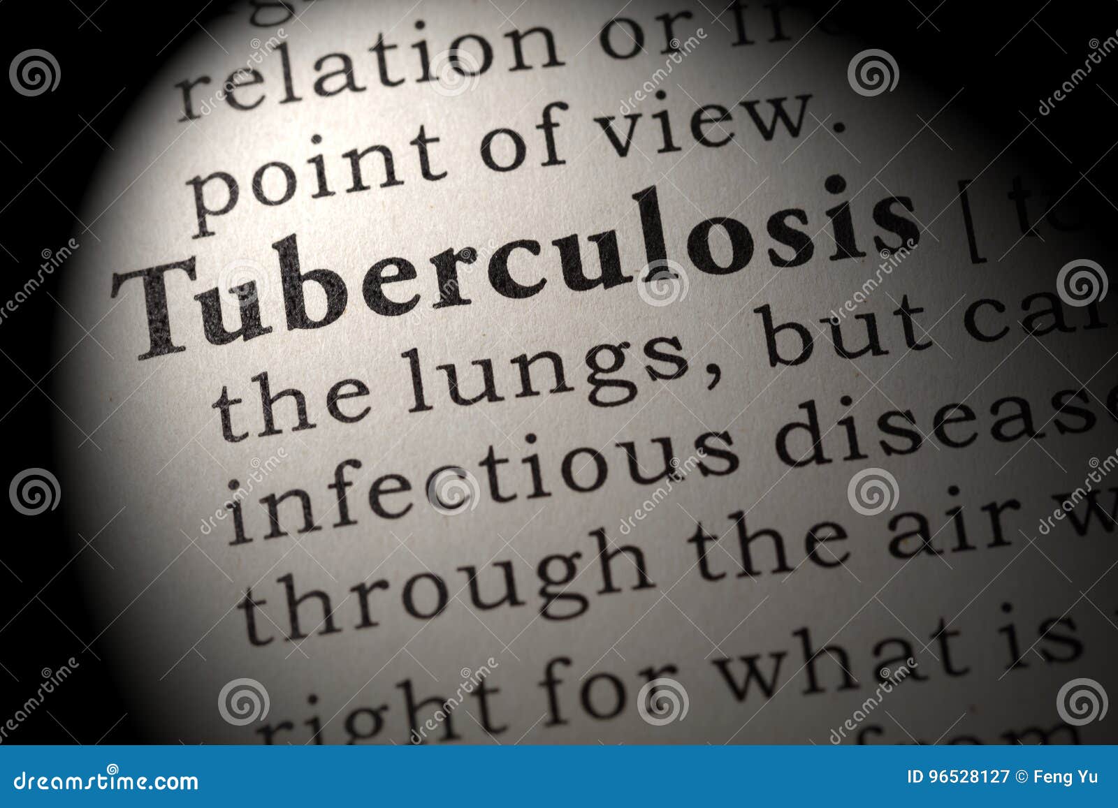 Definition of Tuberculosis stock image. Image of close - 96528127