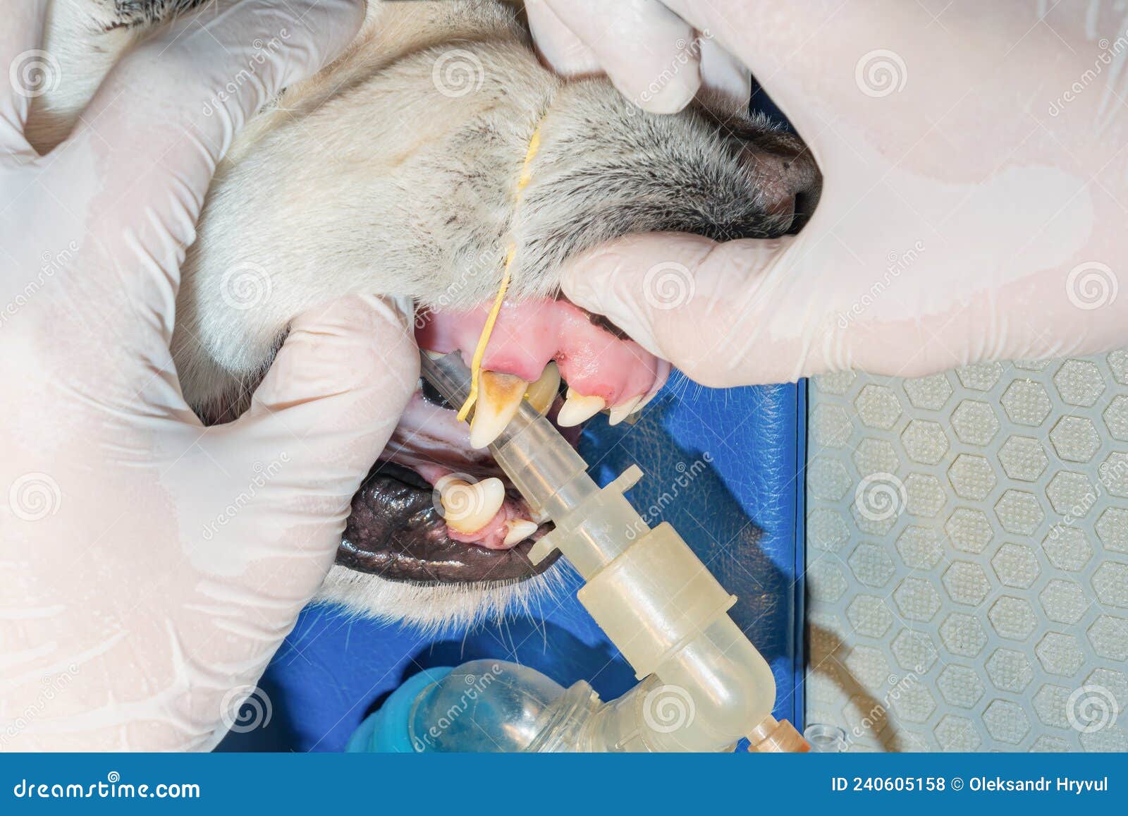 Deformation of the Gums of the Upper Jaw. Improper Bite Stock Photo ...