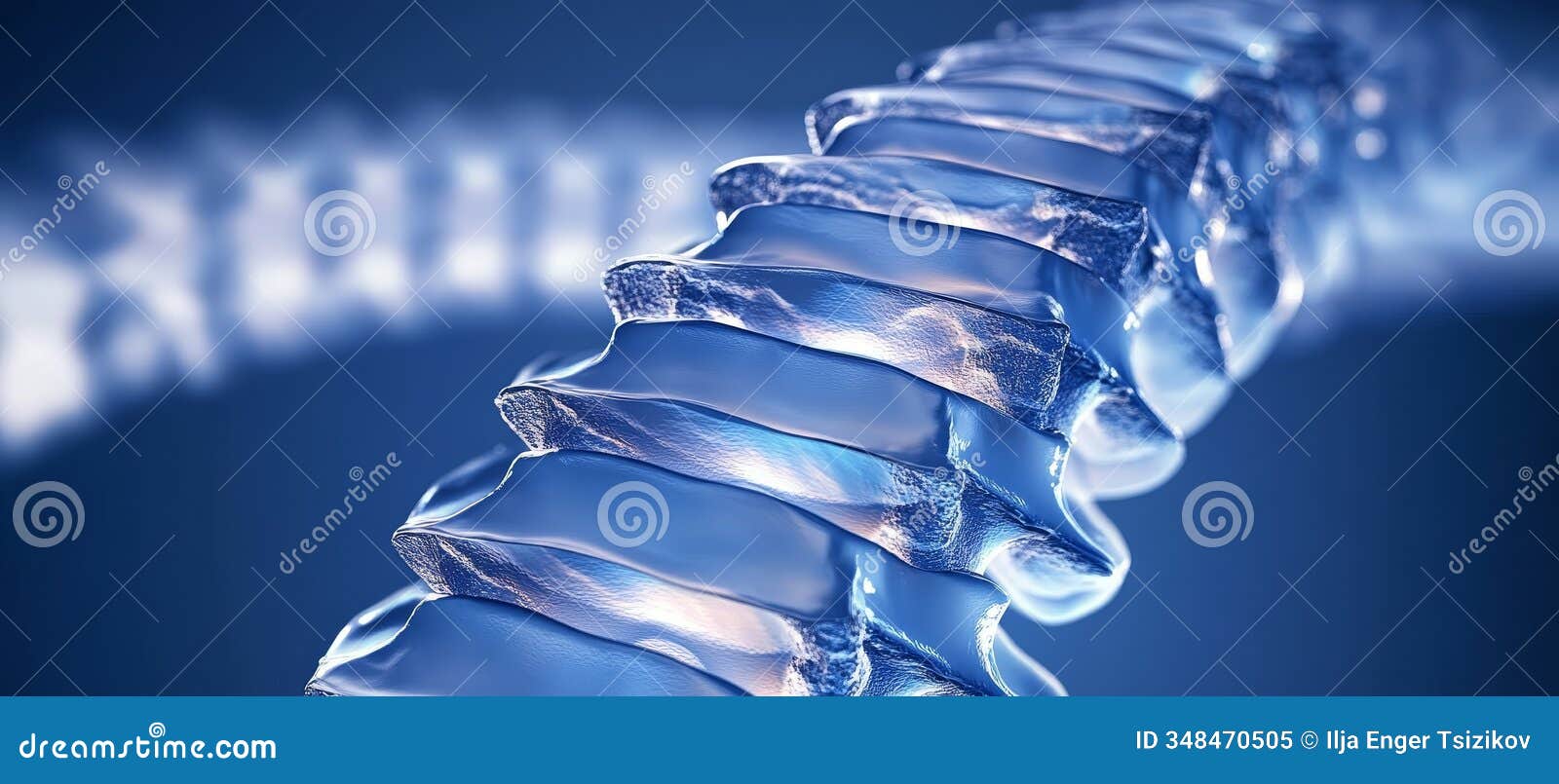 Degenerative Spine Conditions XRay Reveals Spondylosis Bone Spurs And ...