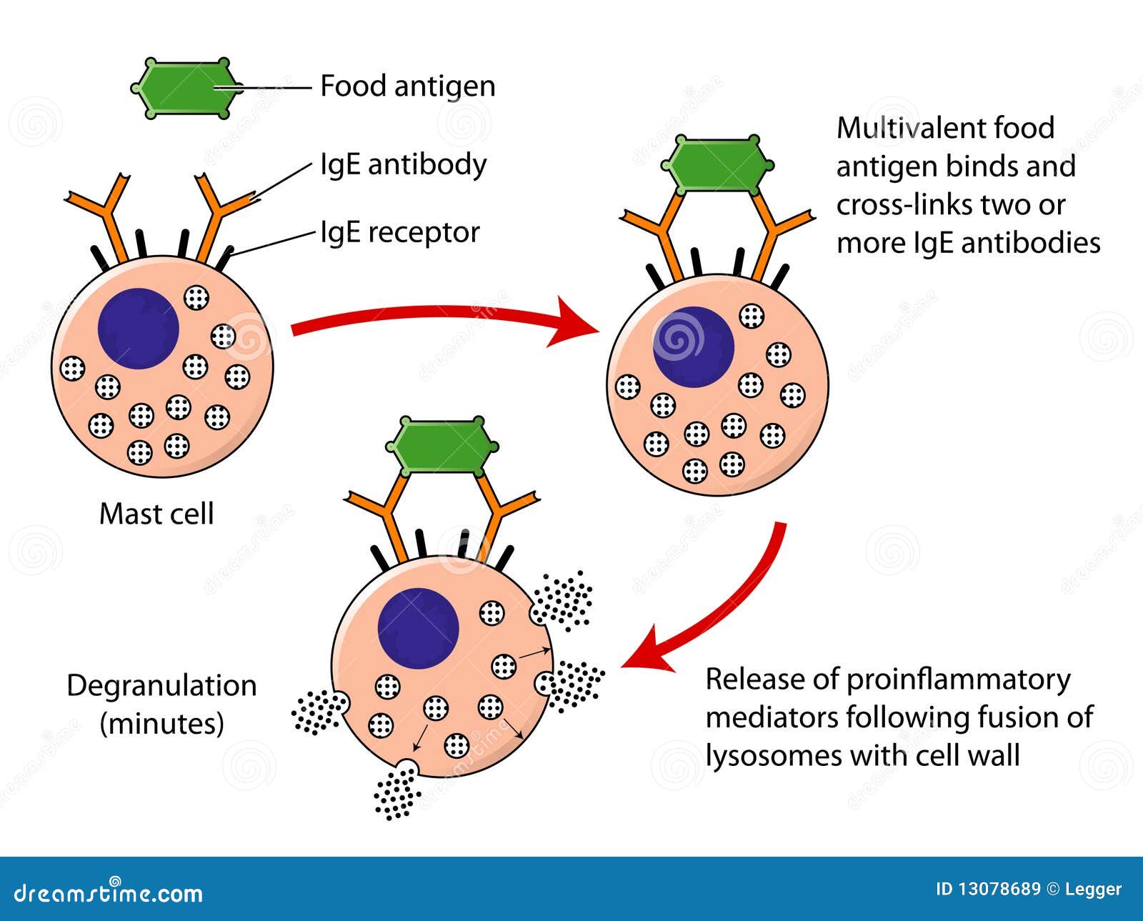 Degranulation de mastocyte illustration de vecteur. Illustration du ...