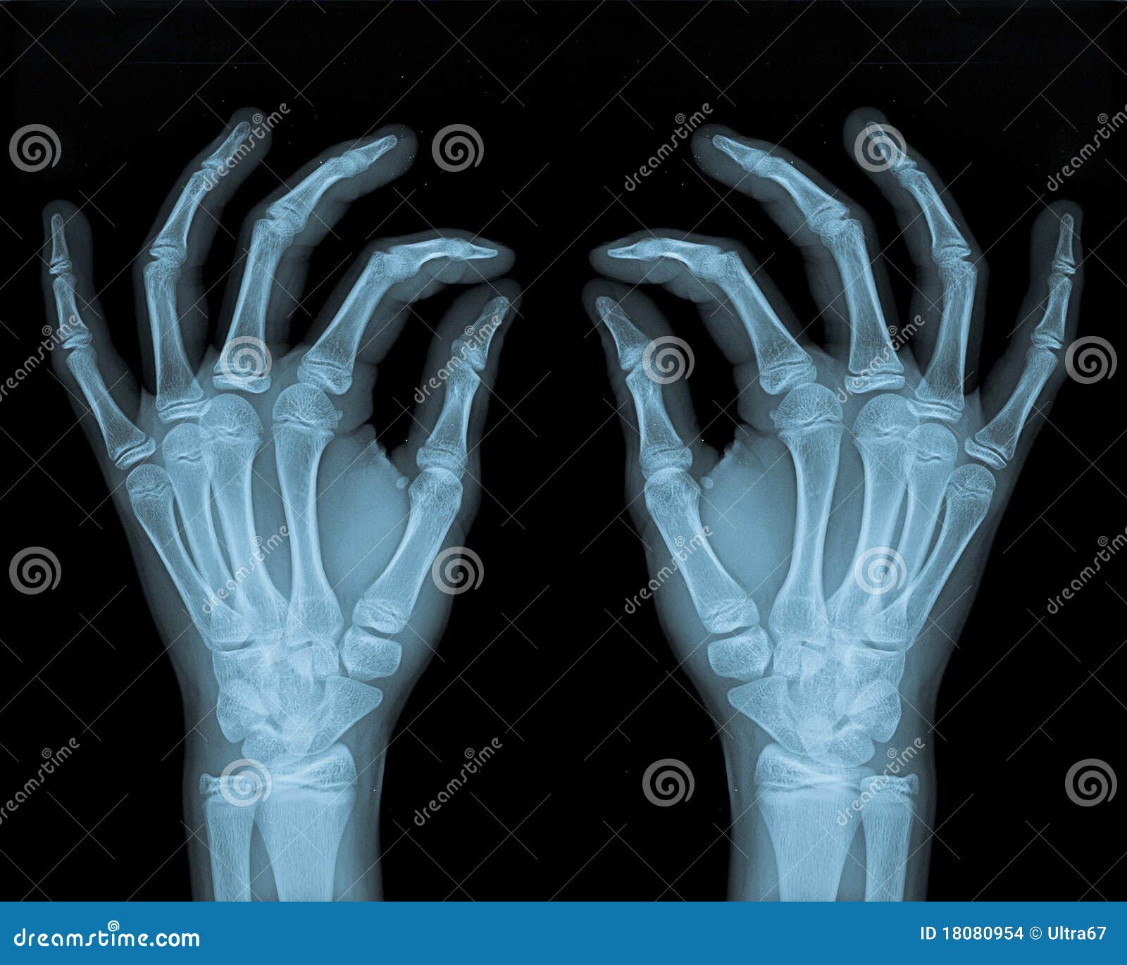 Delicate Hands stock photo. Image of healing, hospital - 18080954