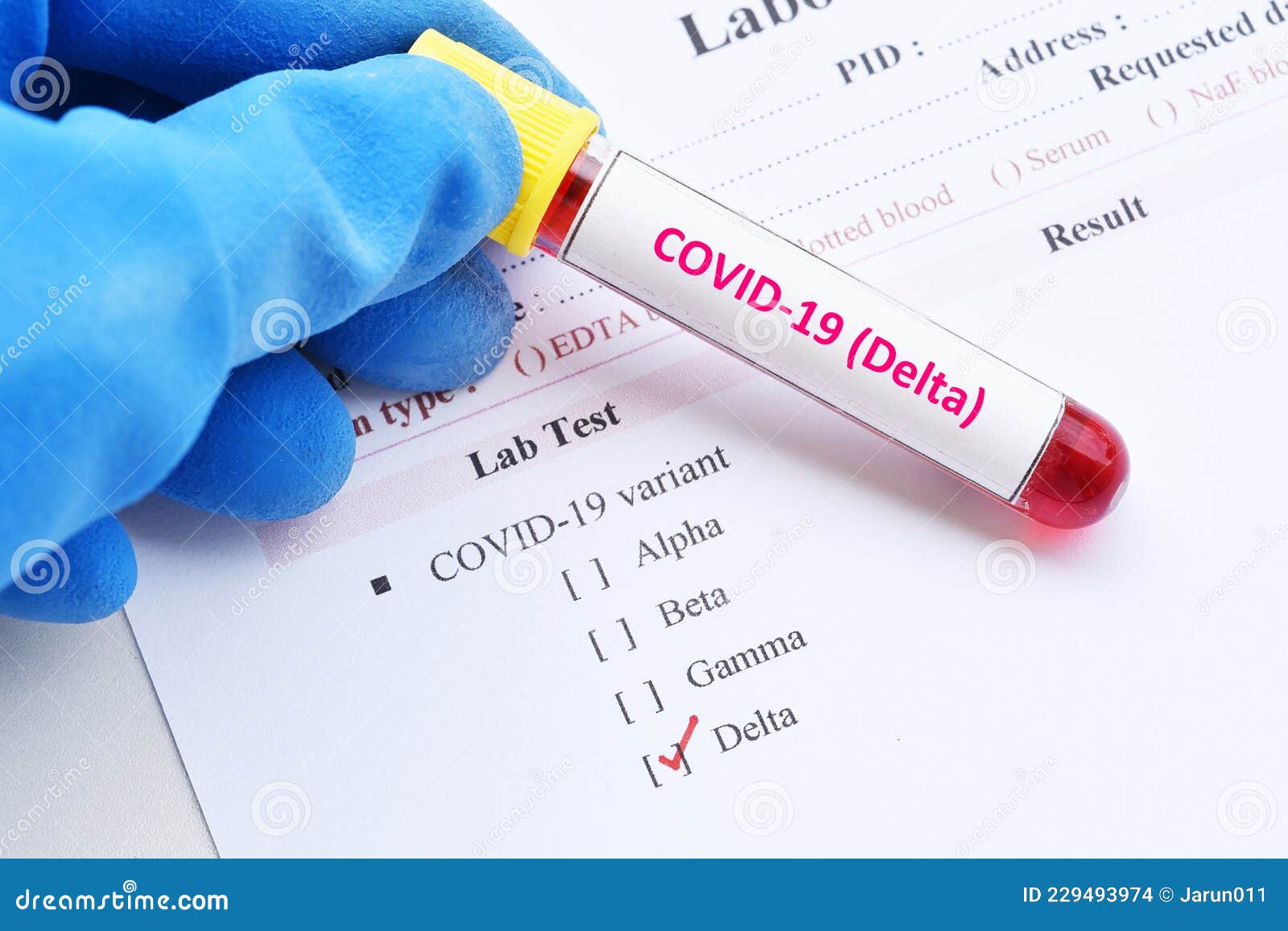 Delta Variant COVID-19 Positive Result Stock Photo - Image of bengal ...