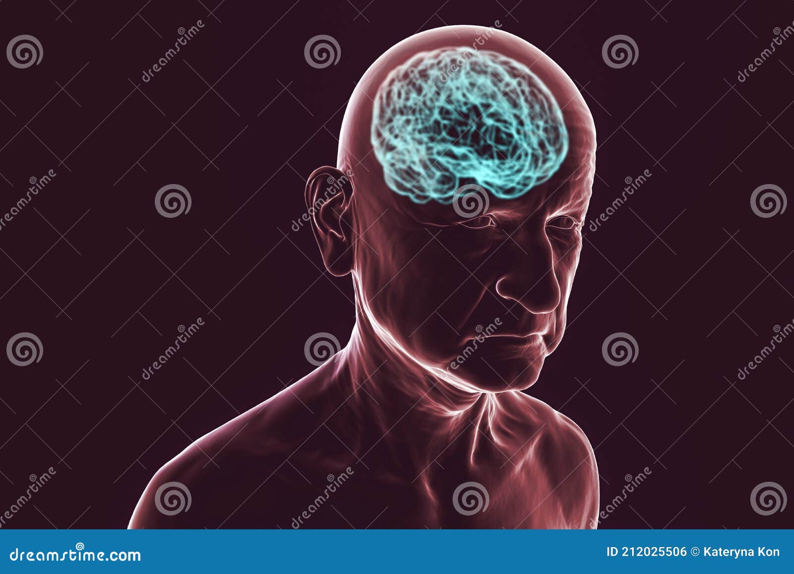 Dementia, Conceptual Illustration | CartoonDealer.com #212025466 Dementia, Conceptual Illustration | CartoonDealer.com #212025466