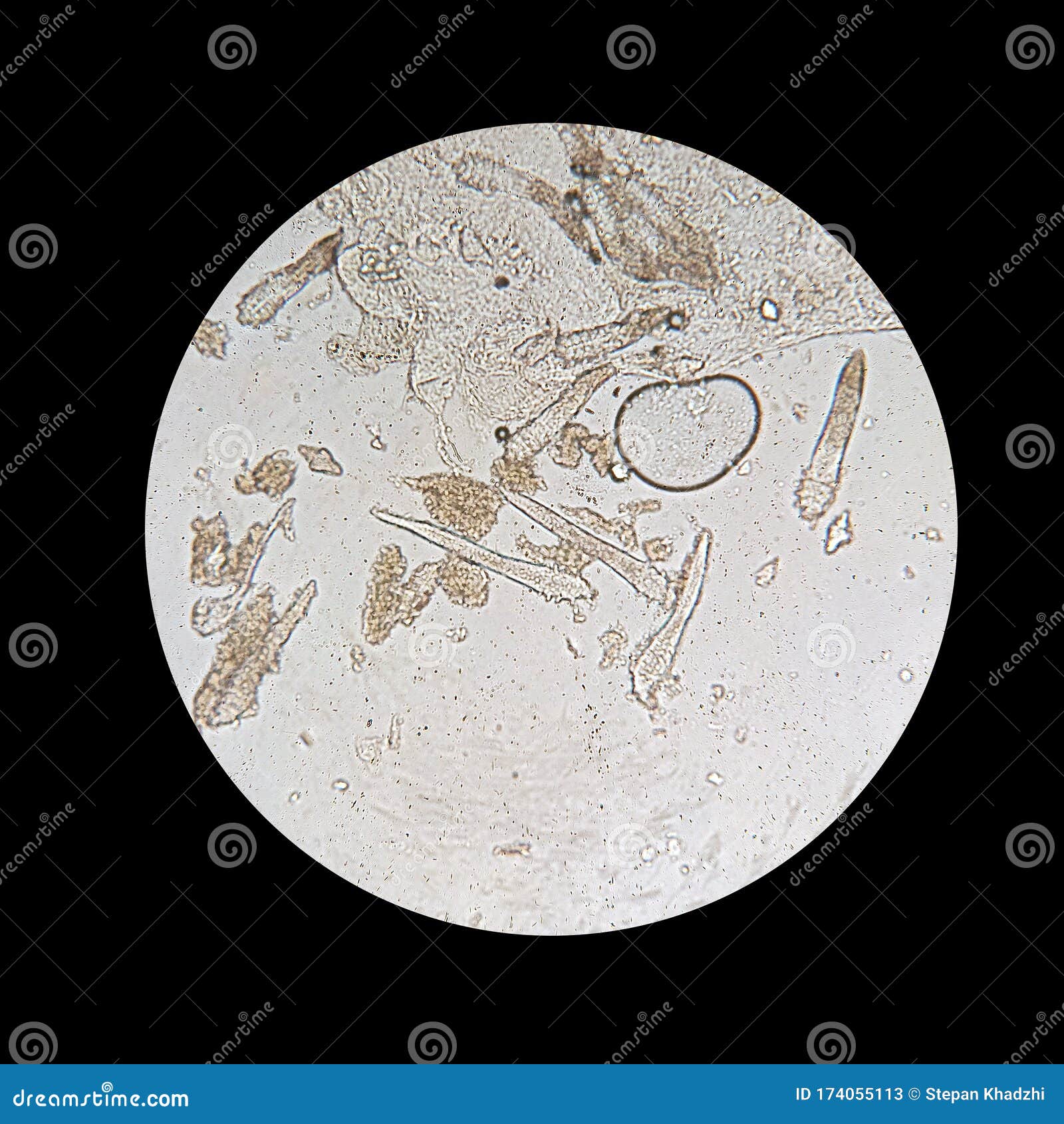 Demodex Mite From A Microscope View. The Parasite Causing A Skin ...