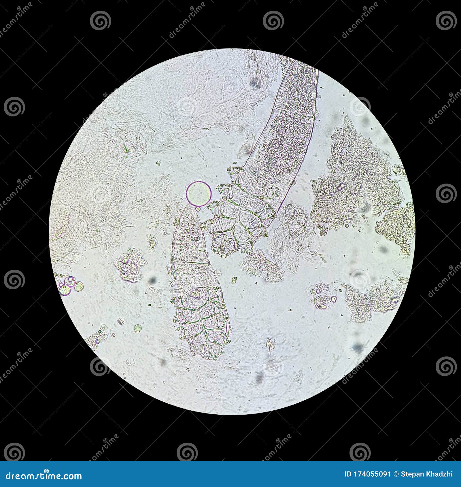 Demodex Mite From A Microscope View. The Parasite Causing A Skin ...