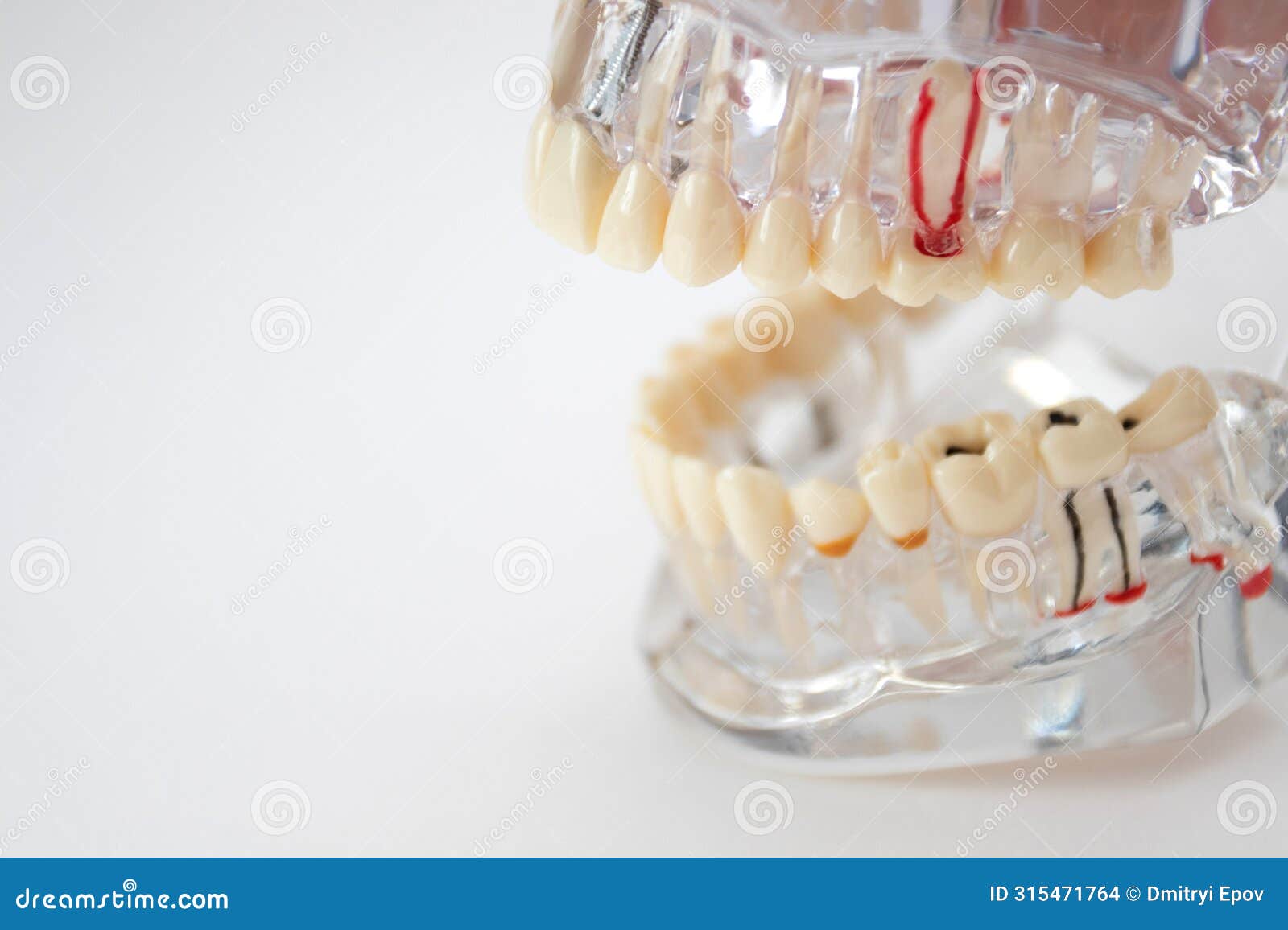 Demonstration Plastic Jaw with Teeth on a White Background Stock Photo ...