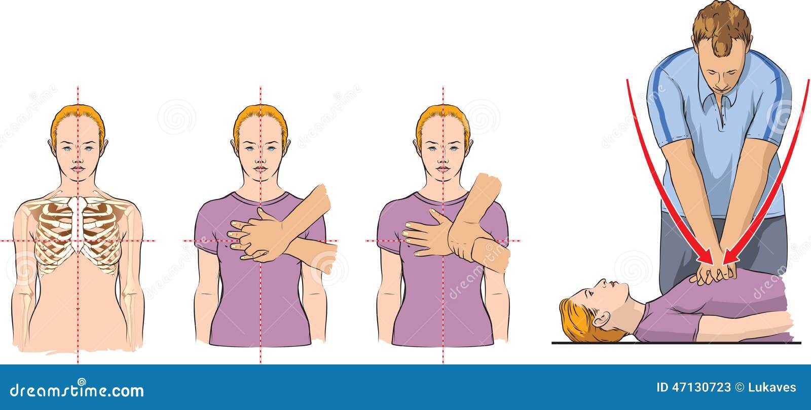 Demostración del CPR ilustración del vector. Ilustración de hembra ...