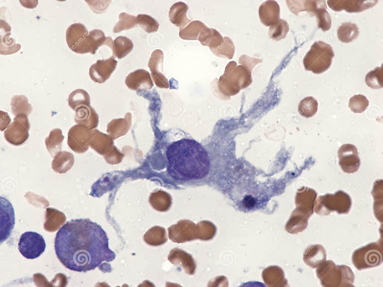 Dendritic Cell in Bone Marrow. Stock Photo - Image of plant, produce ...