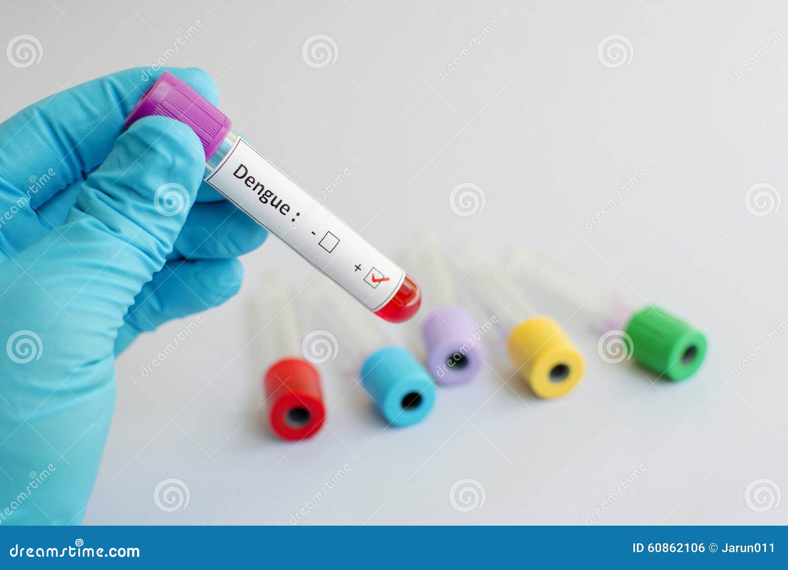 Dengue blood sample stock photo. Image of patient, scientific - 60862106