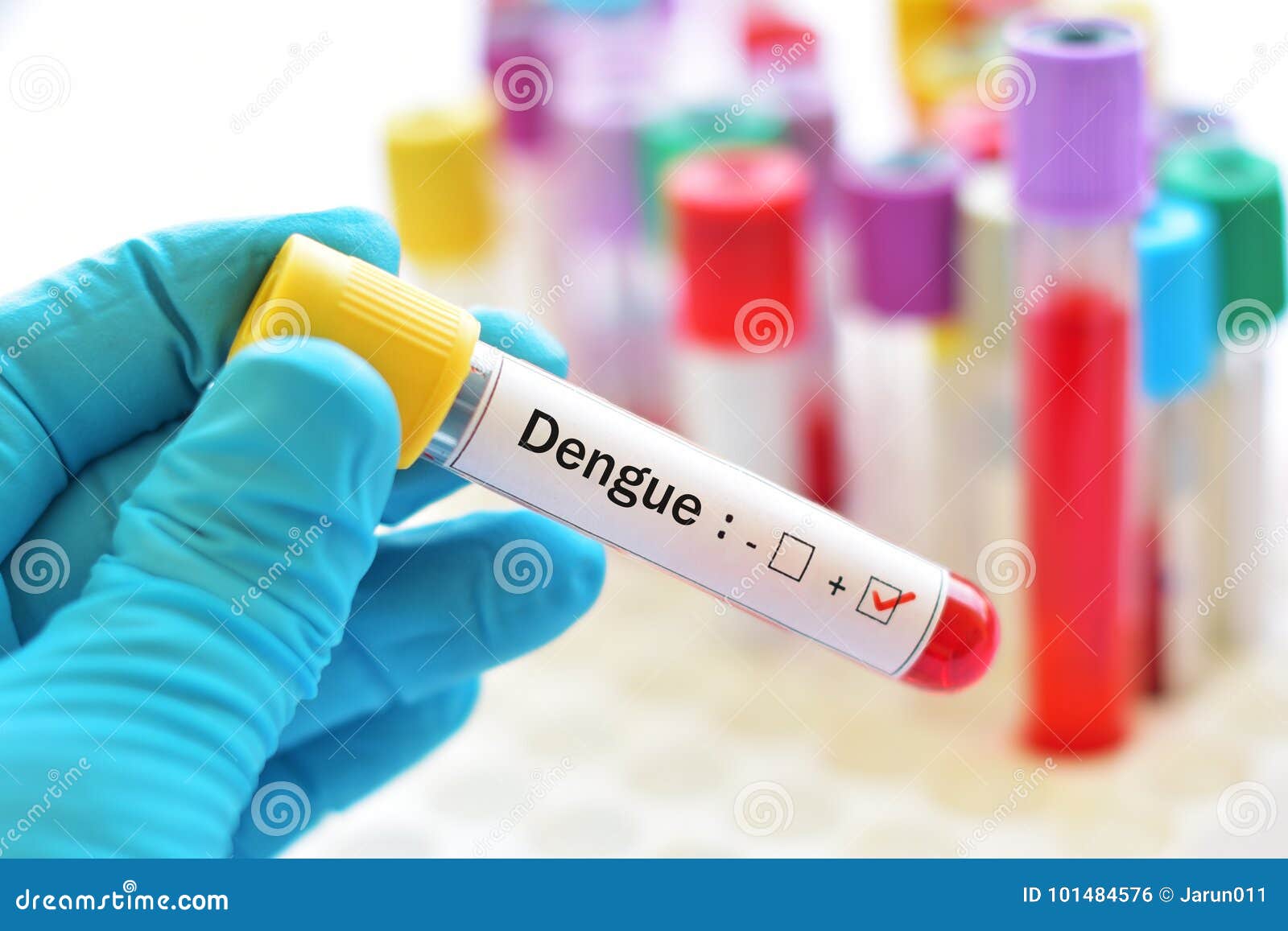 Dengue positive stock photo. Image of dengue, research - 101484576