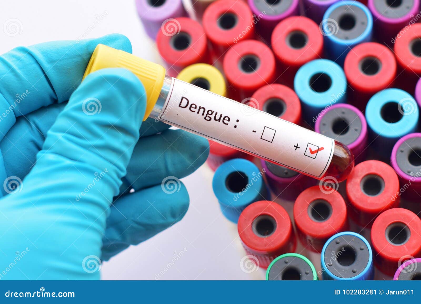 Dengue positive stock image. Image of scientific, epidemic - 102283281