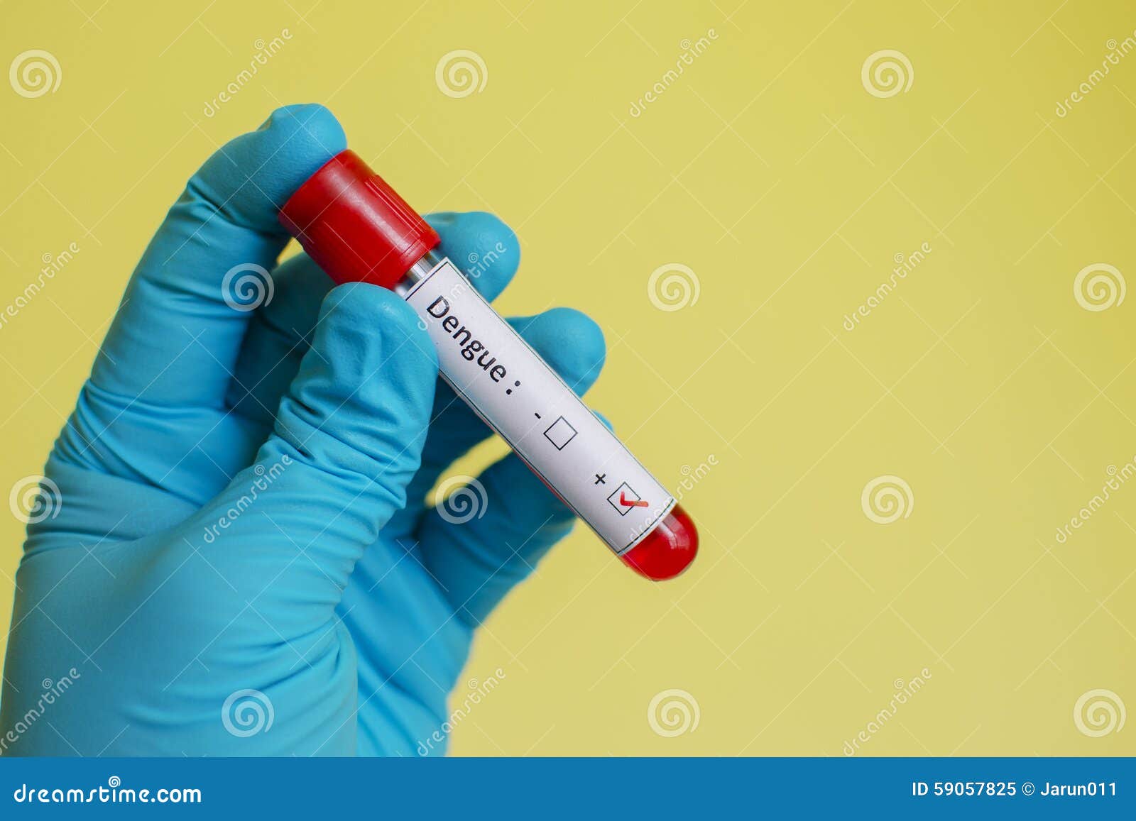 Dengue positive stock image. Image of exam, laboratory - 59057825