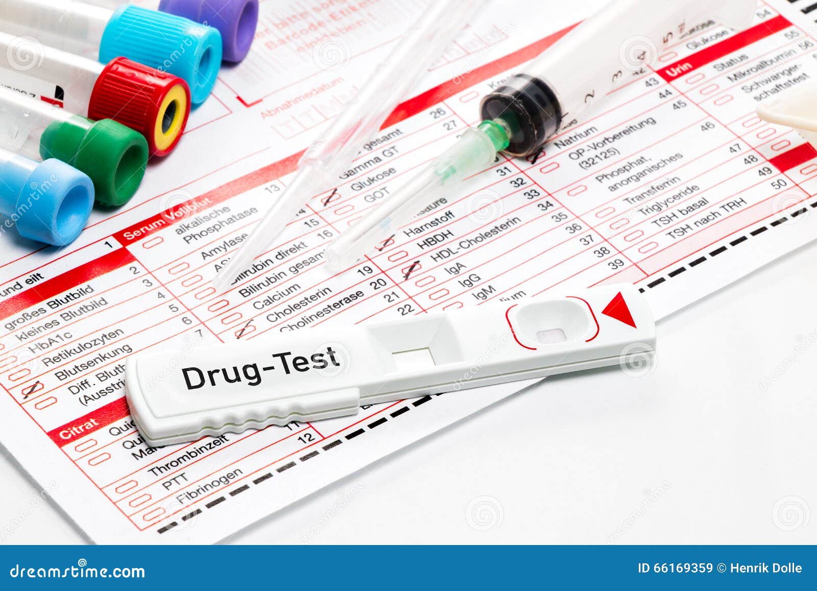 Dengue Quick Test stock image. Image of blood, investigate - 66169359
