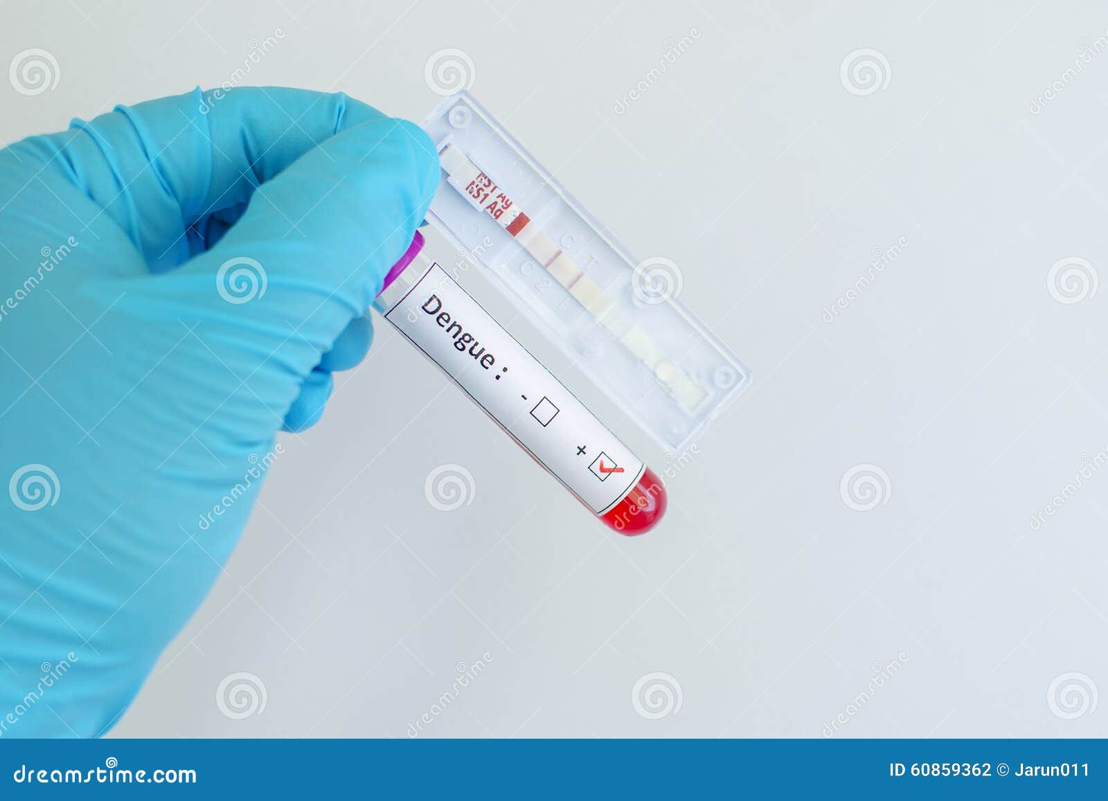 Dengue testing positive stock photo. Image of culex, dengue - 60859362