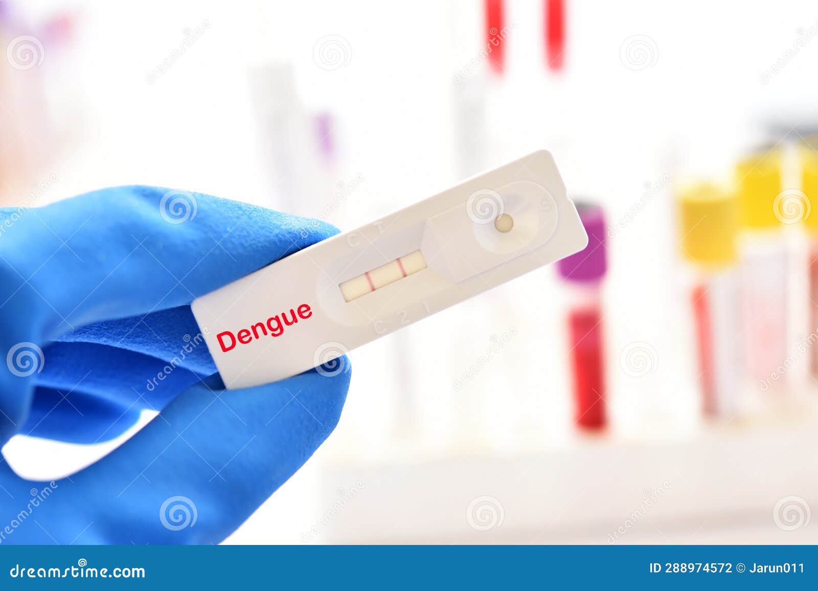 Dengue virus positive test stock photo. Image of health - 288974572