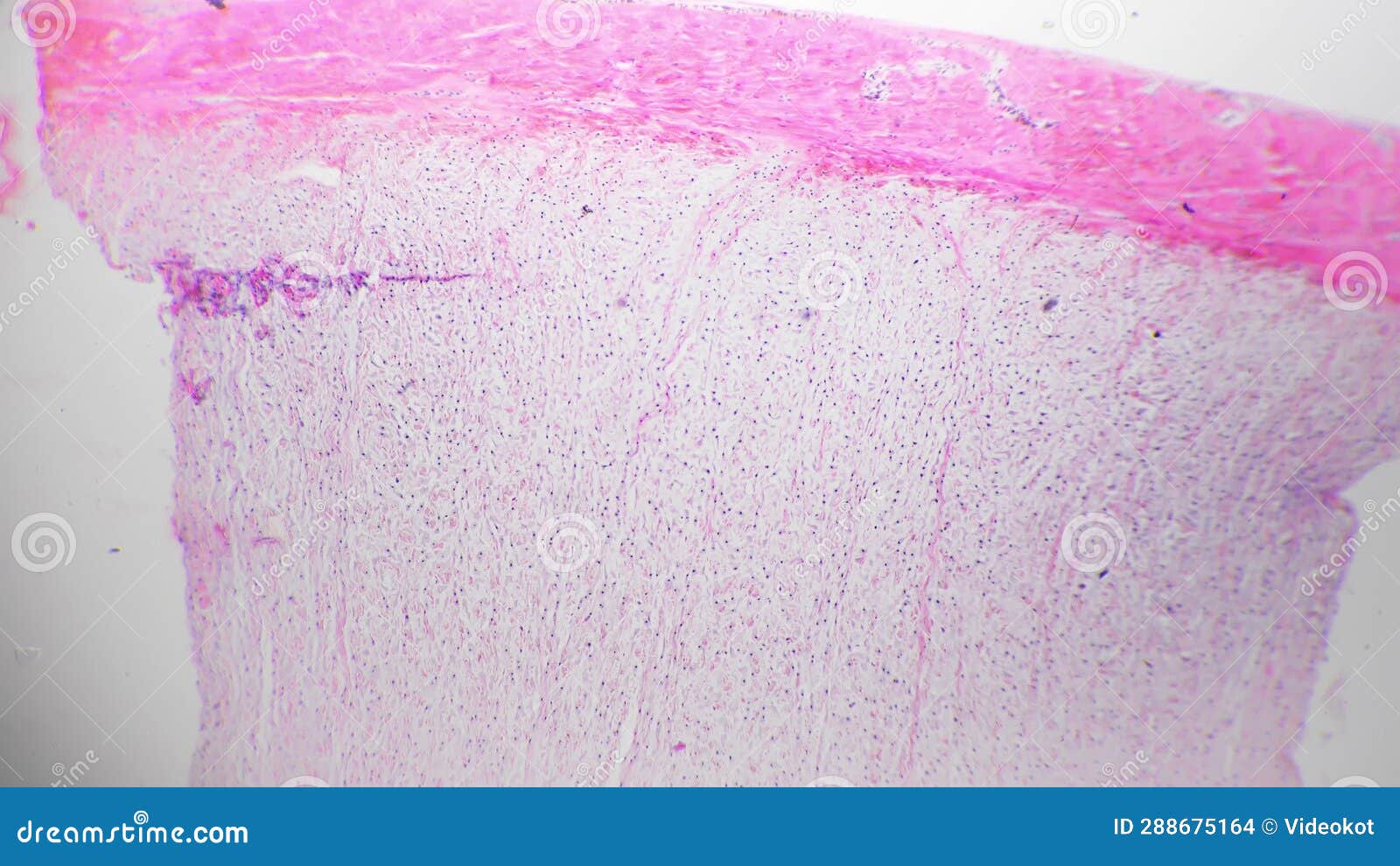 Dense Connective Tissue of Human Whole Mount Filmed Under Microscope ...
