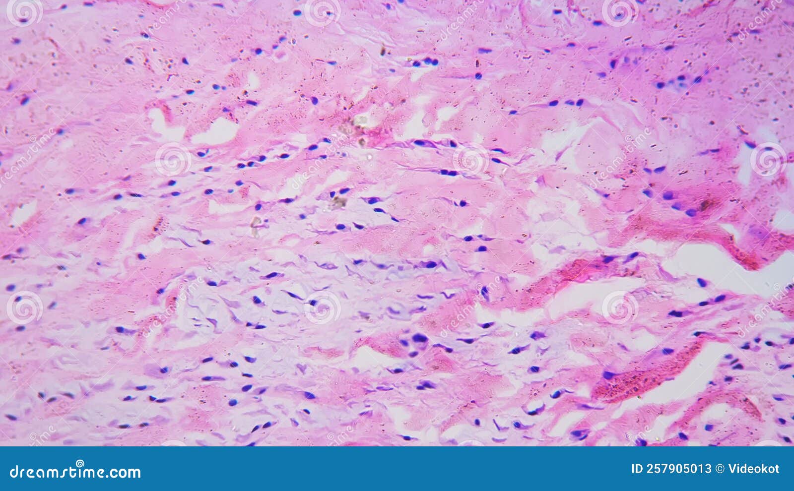 Dense Connective Tissue in Longitudinal Section Filmed by Microscope ...