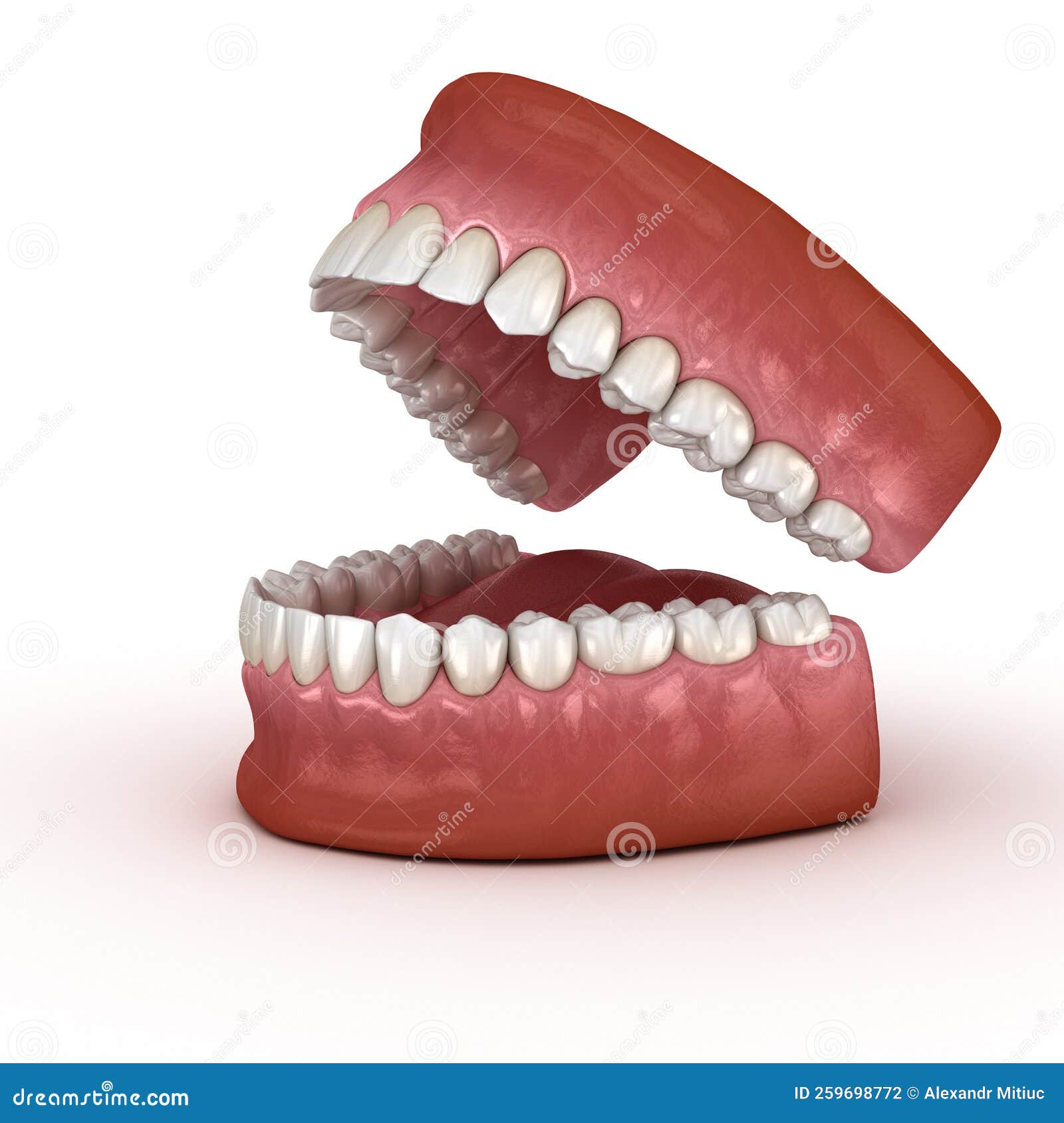 Dental Anatomy - Opened Dentures. Medically Accurate Dental 3D ...