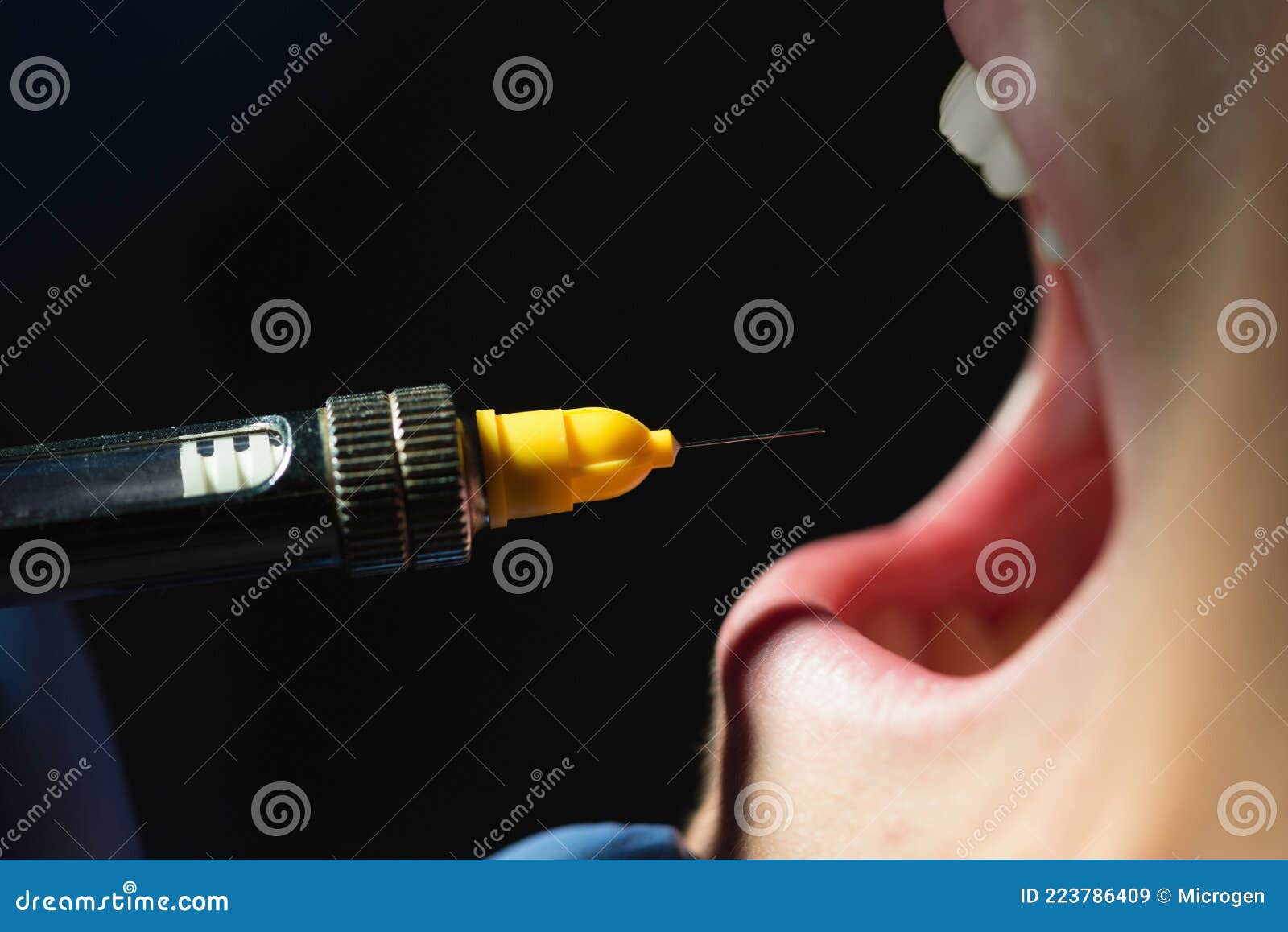 Dental anesthesia stock image. Image of medicine, equipment - 223786409