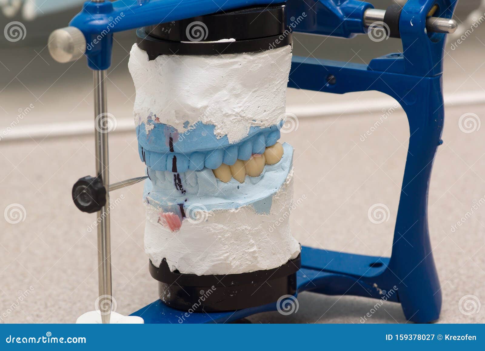Dental Articulator with Plastered Dental Models Stock Image - Image of ...