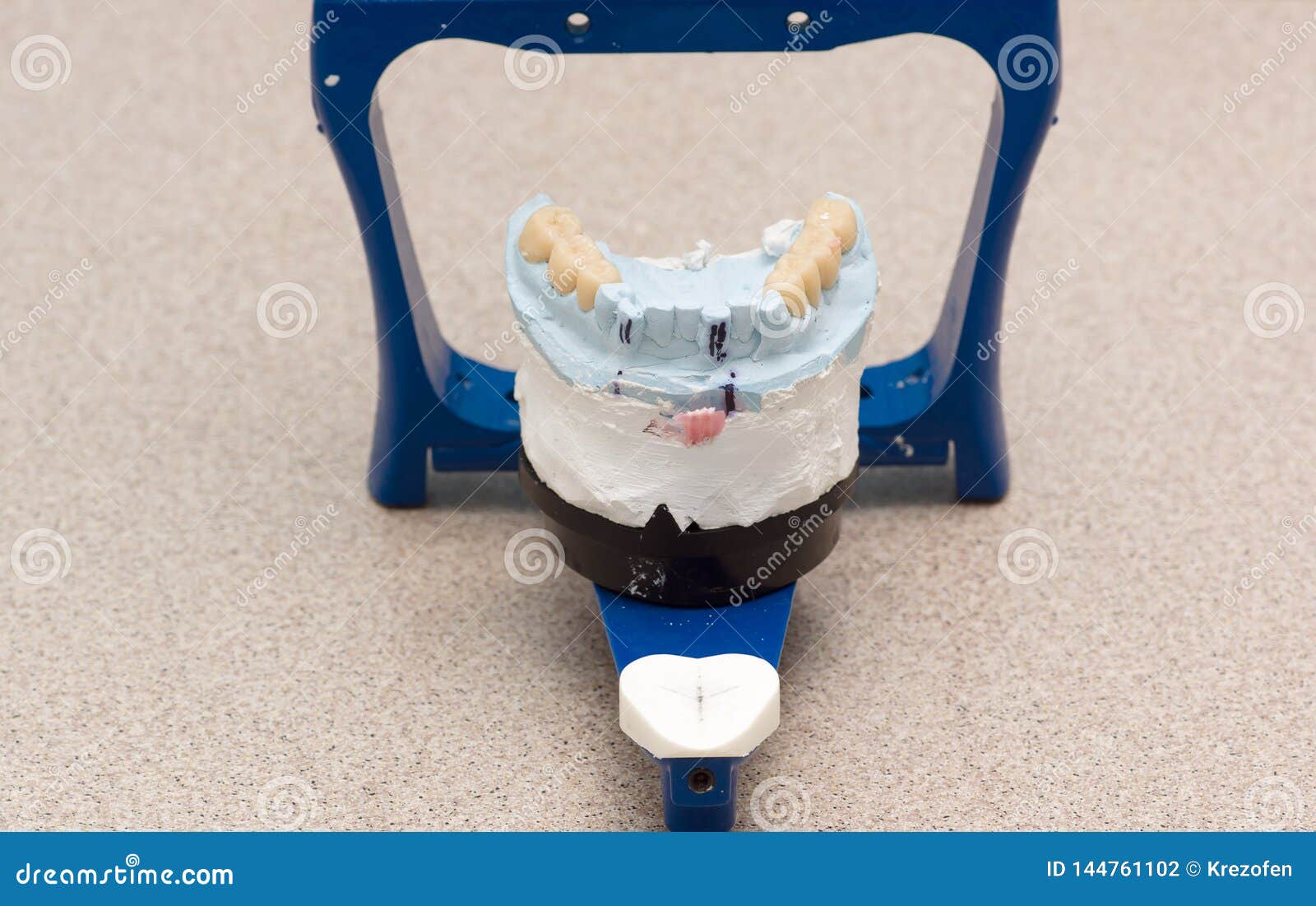Dental Articulator with Plastered Dental Models Stock Photo - Image of ...