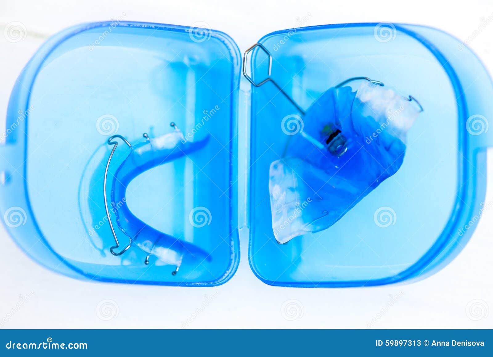 Dental Blue Removable Braces or Retainers for Teeth in the Box Stock ...