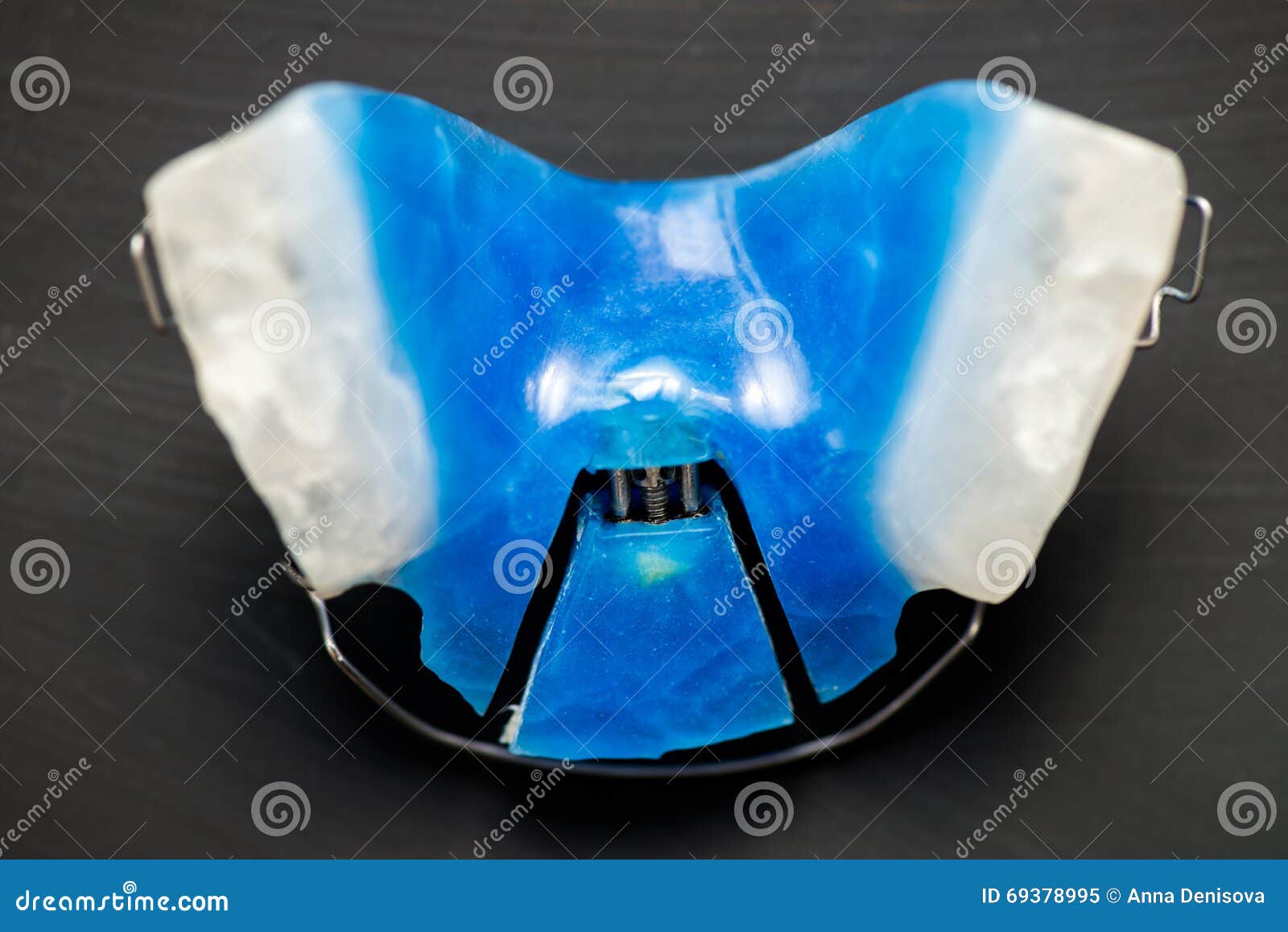 Dental Blue Removable Braces or Retainers for Teeth Stock Image - Image ...