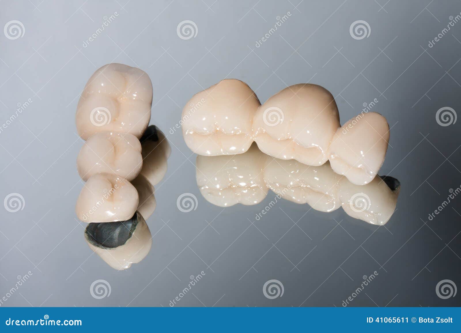 Dental Bridge Stock Photo | CartoonDealer.com #30240456