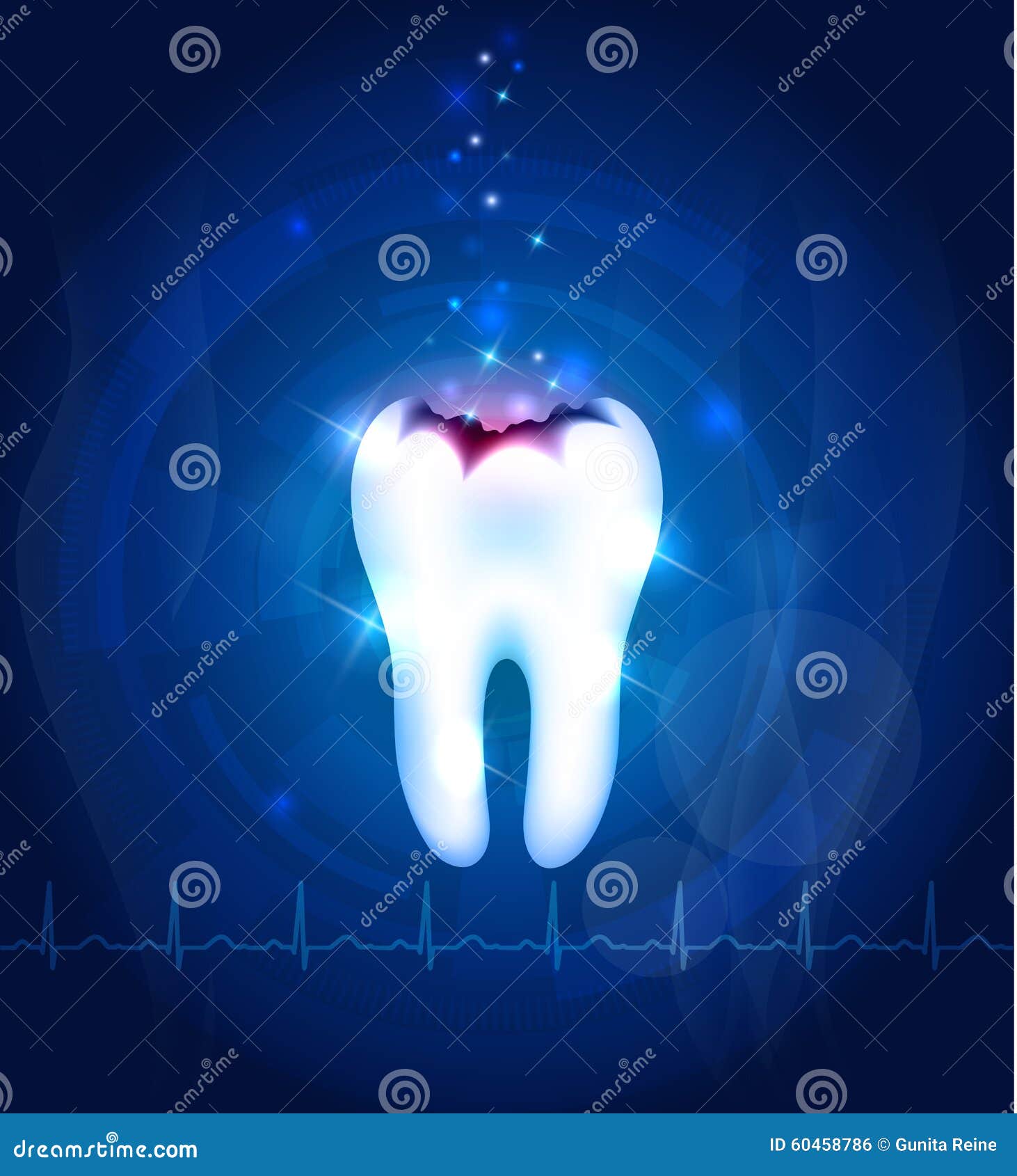 Dental Caries Abstract Blue Background Vector Illustration ...
