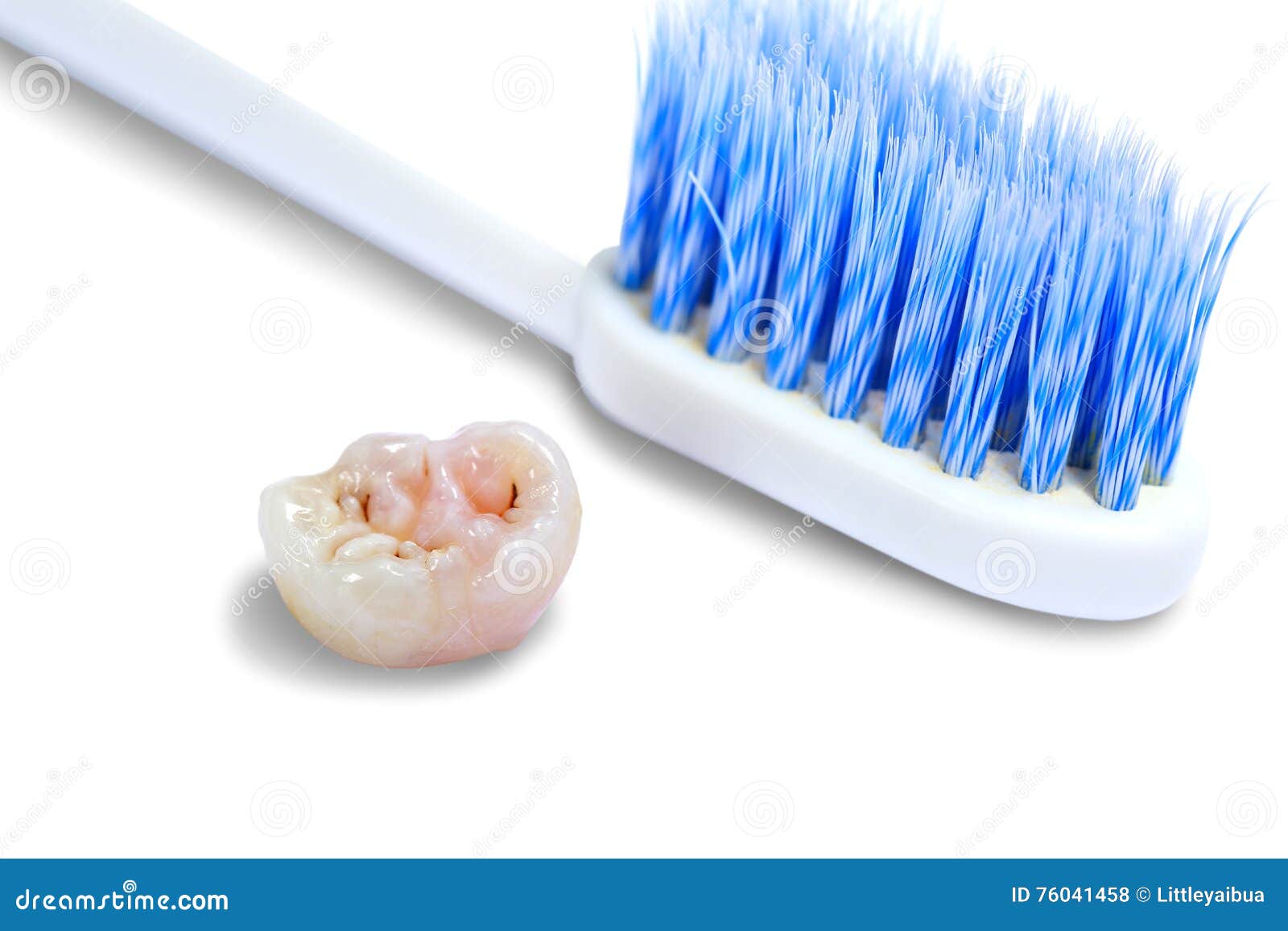 Dental Caries and Tooth Brush. Stock Photo - Image of prophylactic ...
