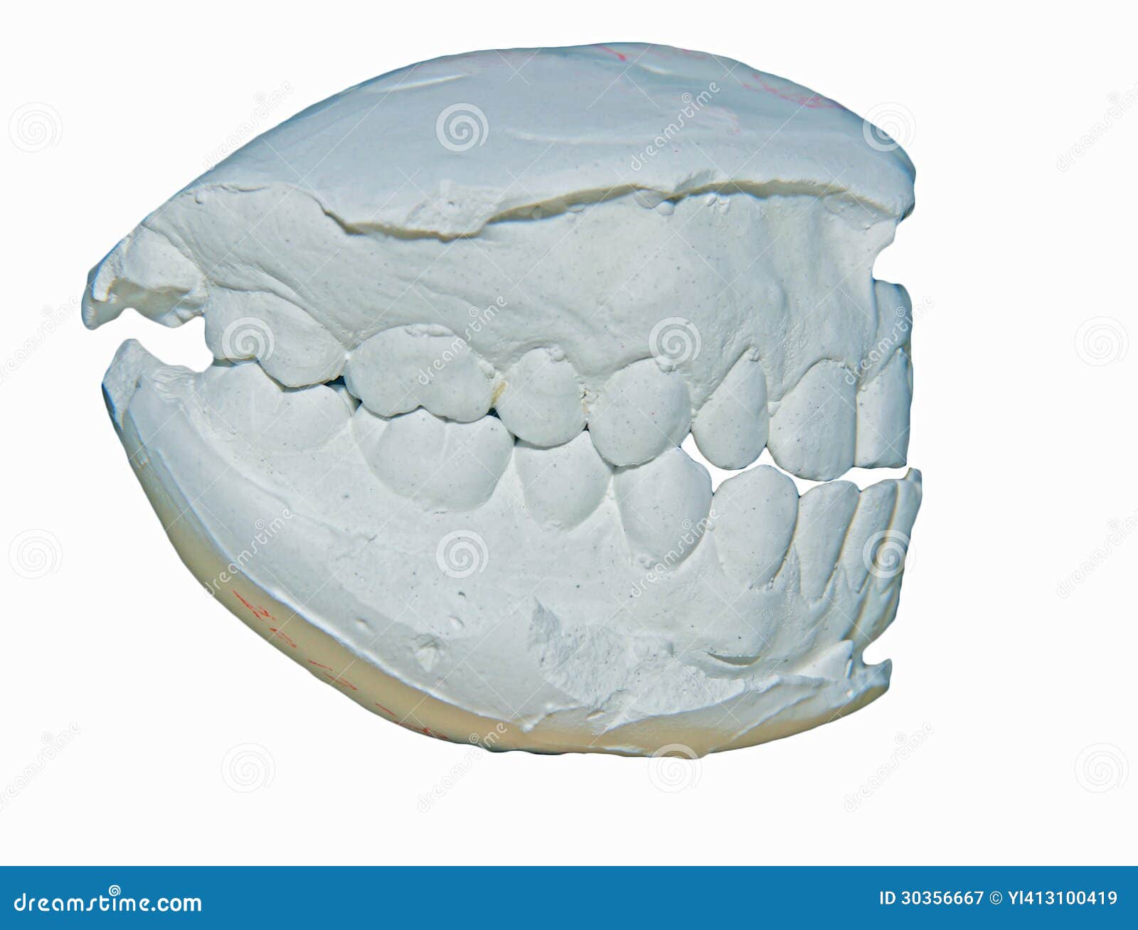 Dental cast stock image. Image of parget, gesso, important - 30356667