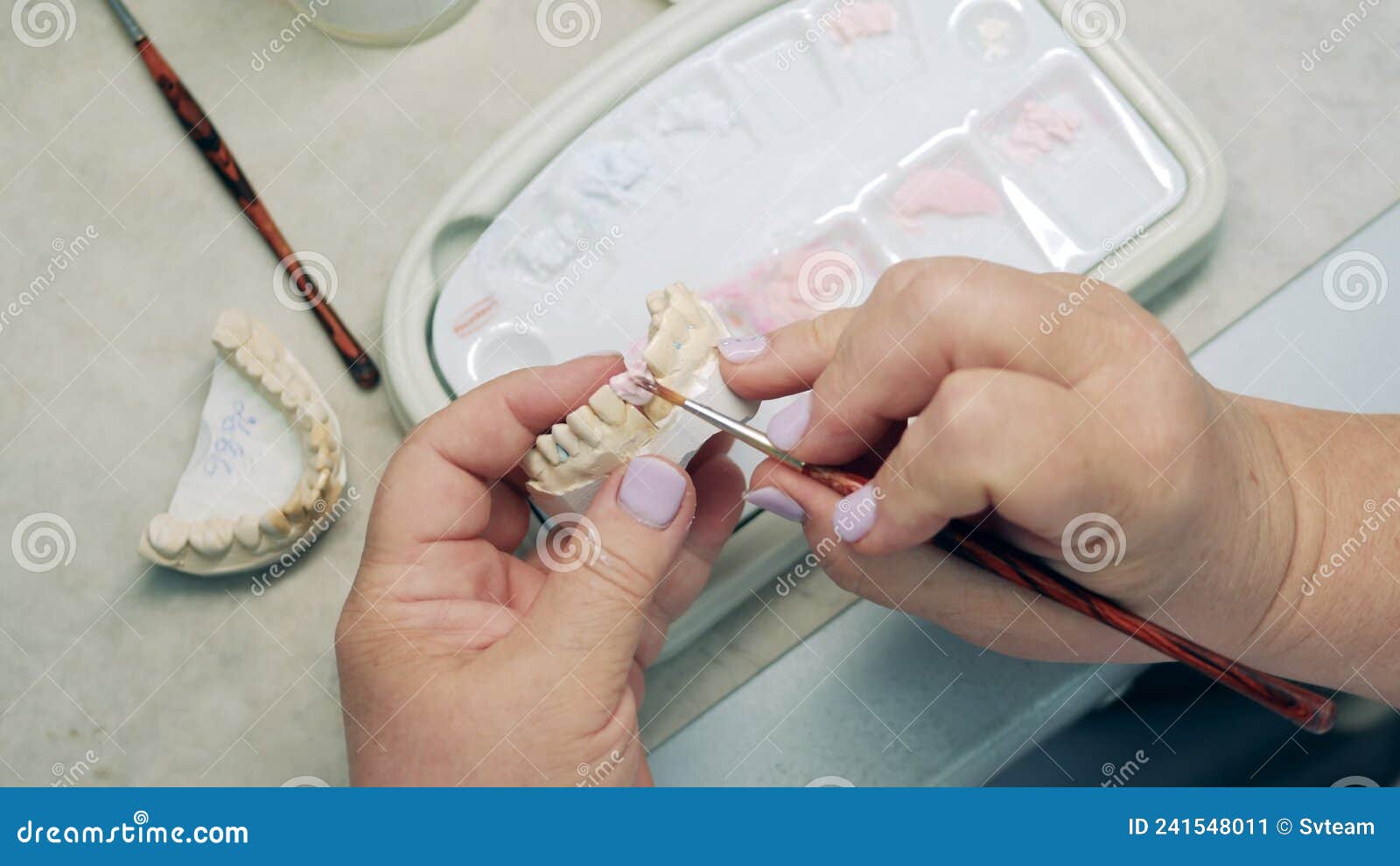 Dental Cast Model is Getting Made by a Doctor Stock Video - Video of ...