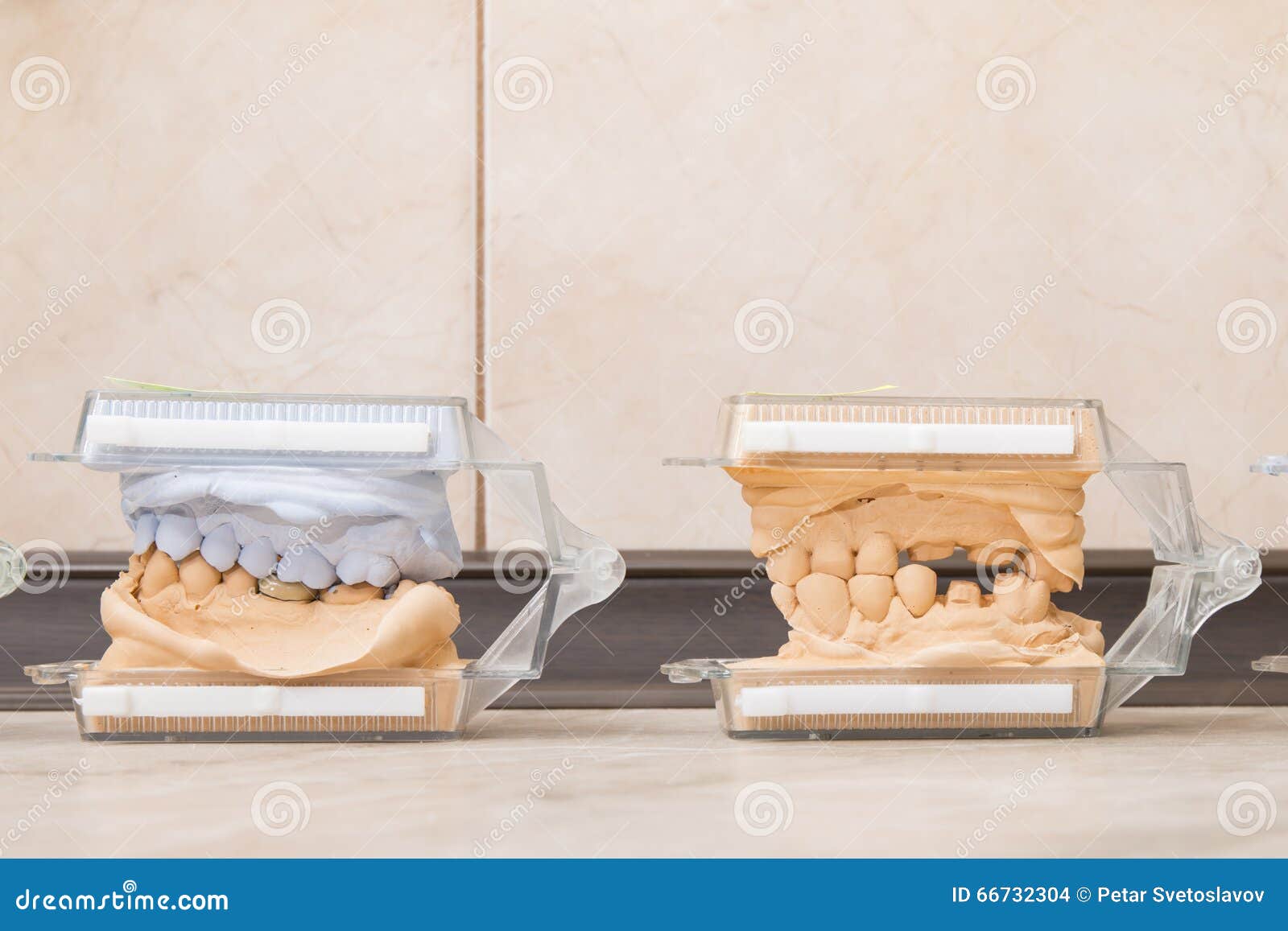 Dental Casting Gypsum Models Plaster Stock Photo - Image of maxillar ...