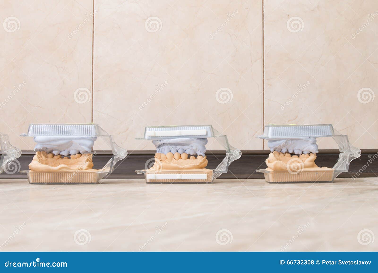 Dental Casting Gypsum Models Plaster Stock Photo - Image of model ...
