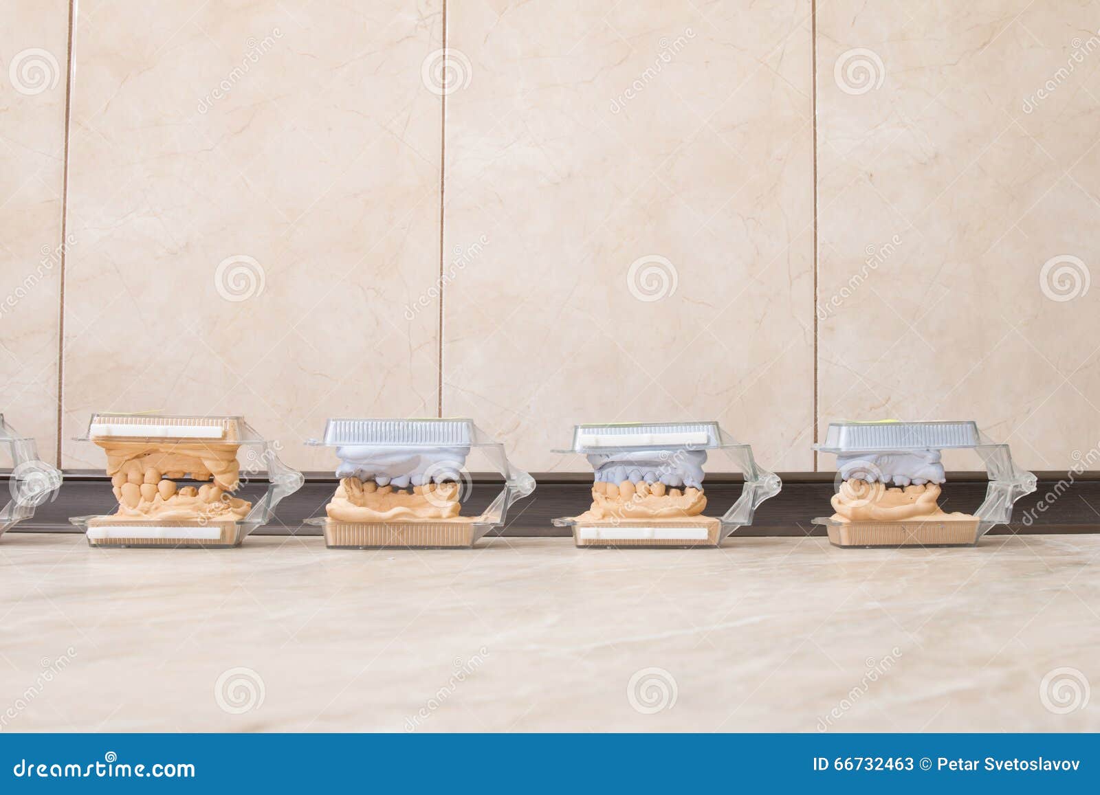 Dental Casting Gypsum Models Plaster Stock Image - Image of maxillar ...