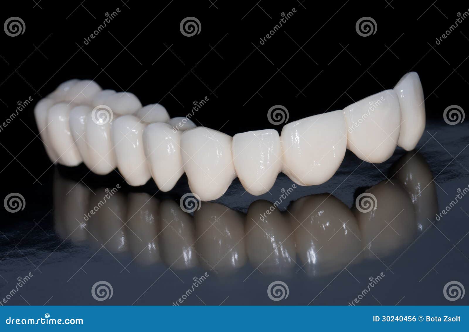 Dental bridge stock photo. Image of reflection, hygiene - 30240456