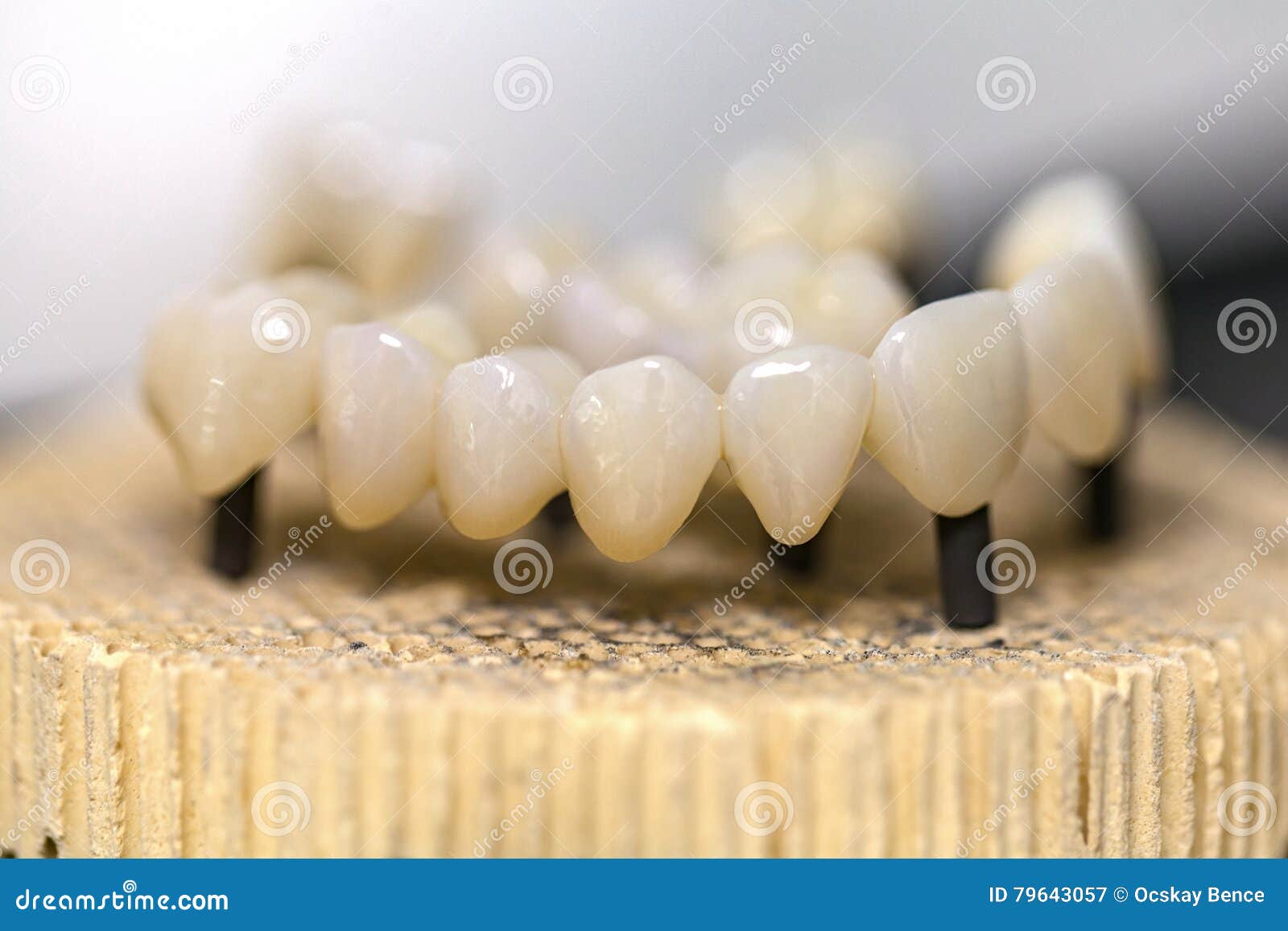 Dental ceramic bridge stock image. Image of health, healthy - 79643057