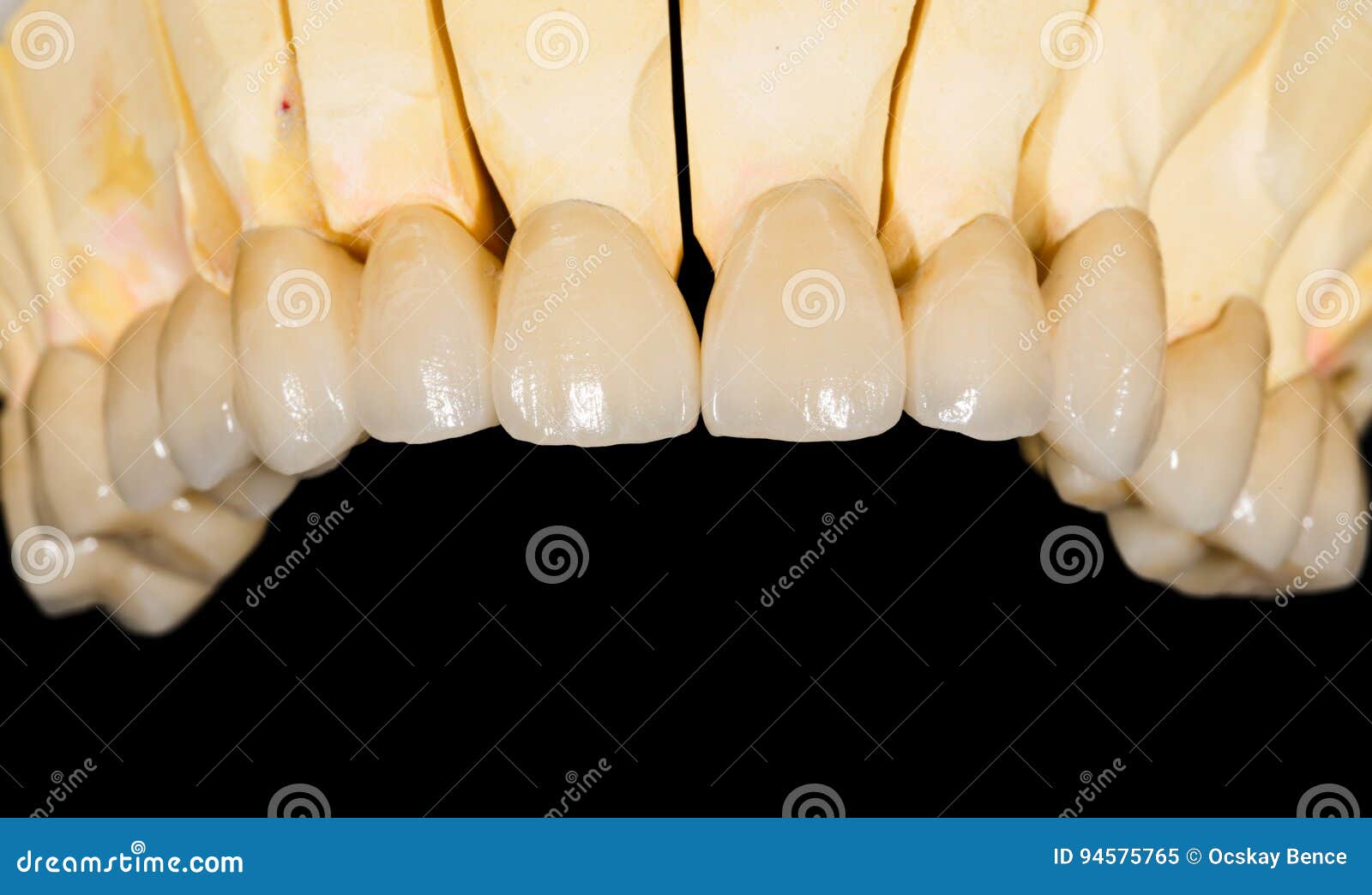 Dental ceramic bridge stock image. Image of model, detail - 94575765
