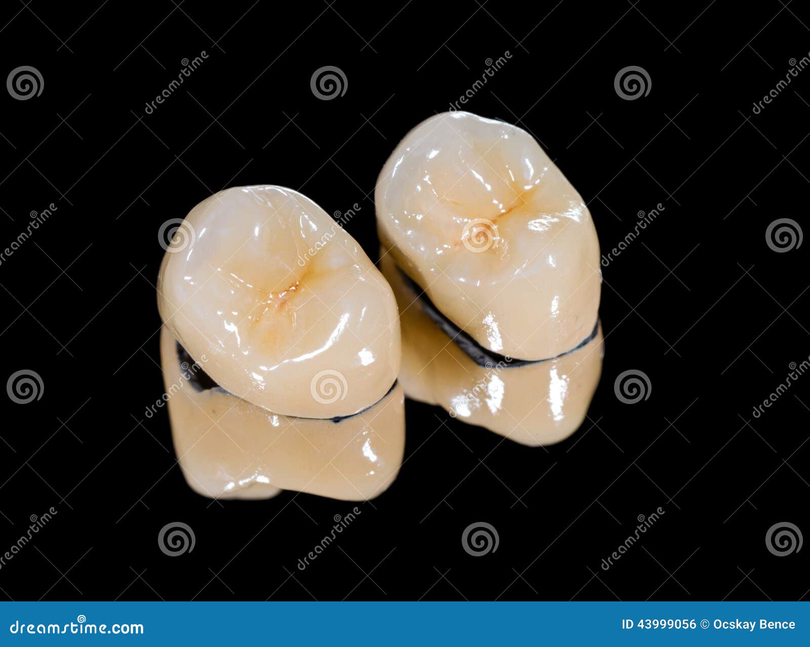 Ceramic Crowns Of Human Teeth Closeup Macro Isolate On Black Background ...