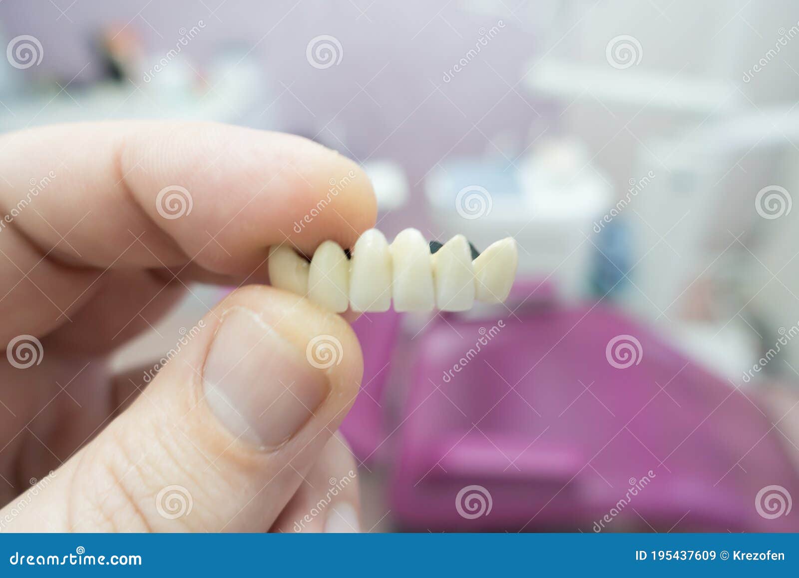 Dental Ceramic Metal Bridges in the Hands Stock Image - Image of ...