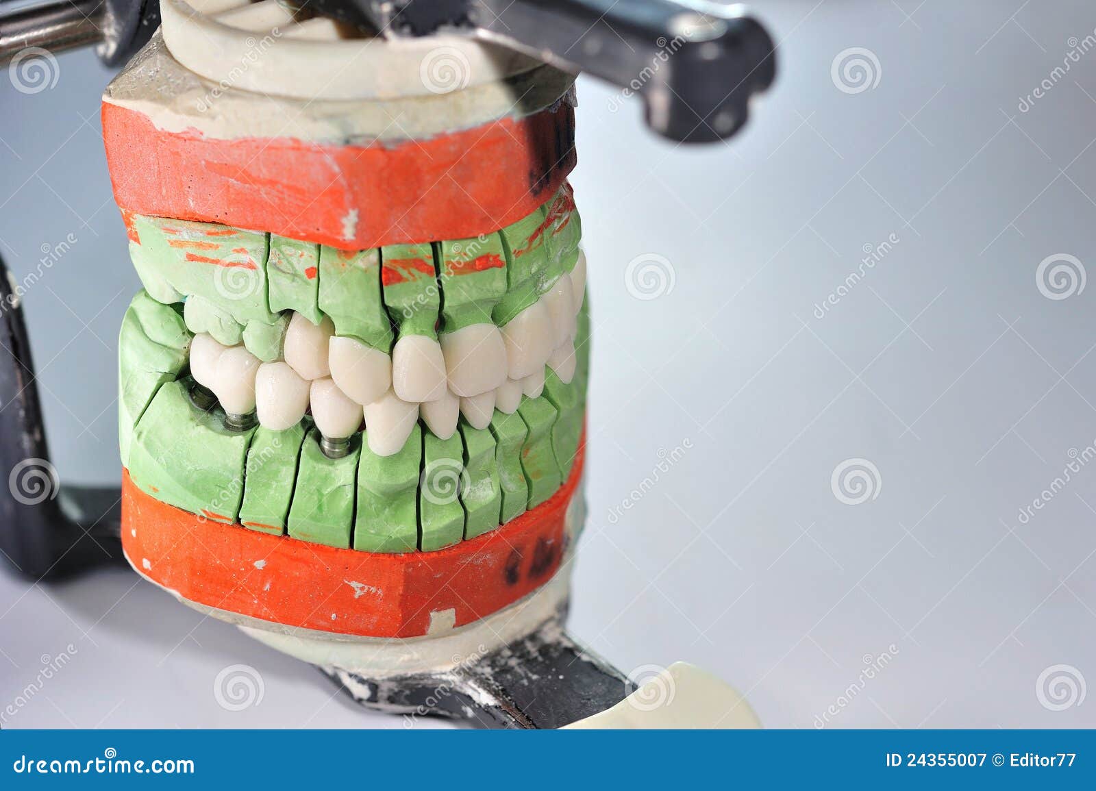 Dental Ceramic Prosthesis with Porcelain Teeth Stock Image - Image of ...