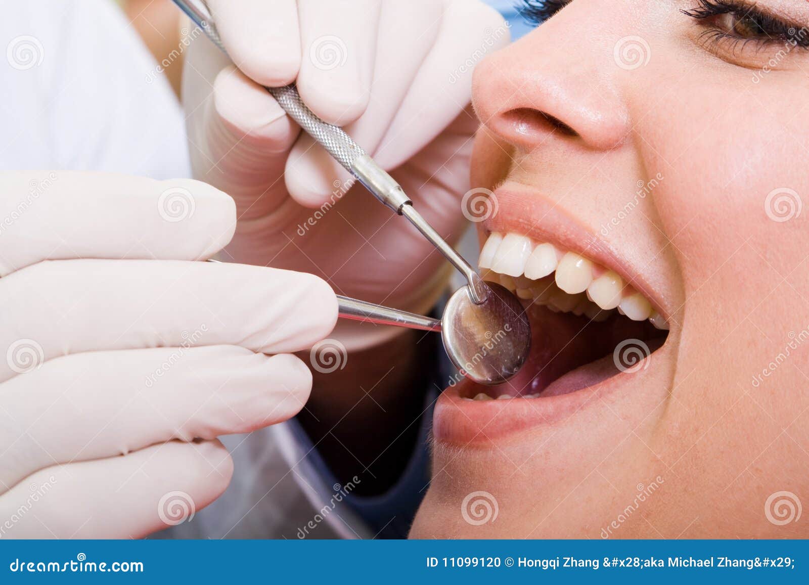 Dental checkup stock photo. Image of dental, adult, checkup - 11099120