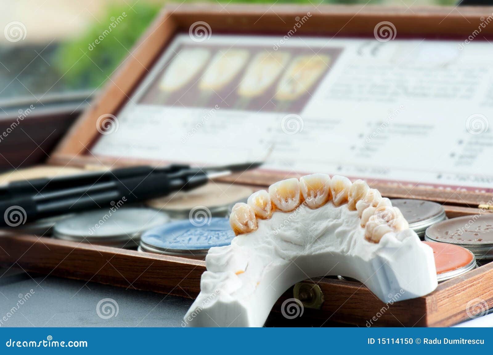 Dental Crown stock photo. Image of tools, tooth, dental - 15114150