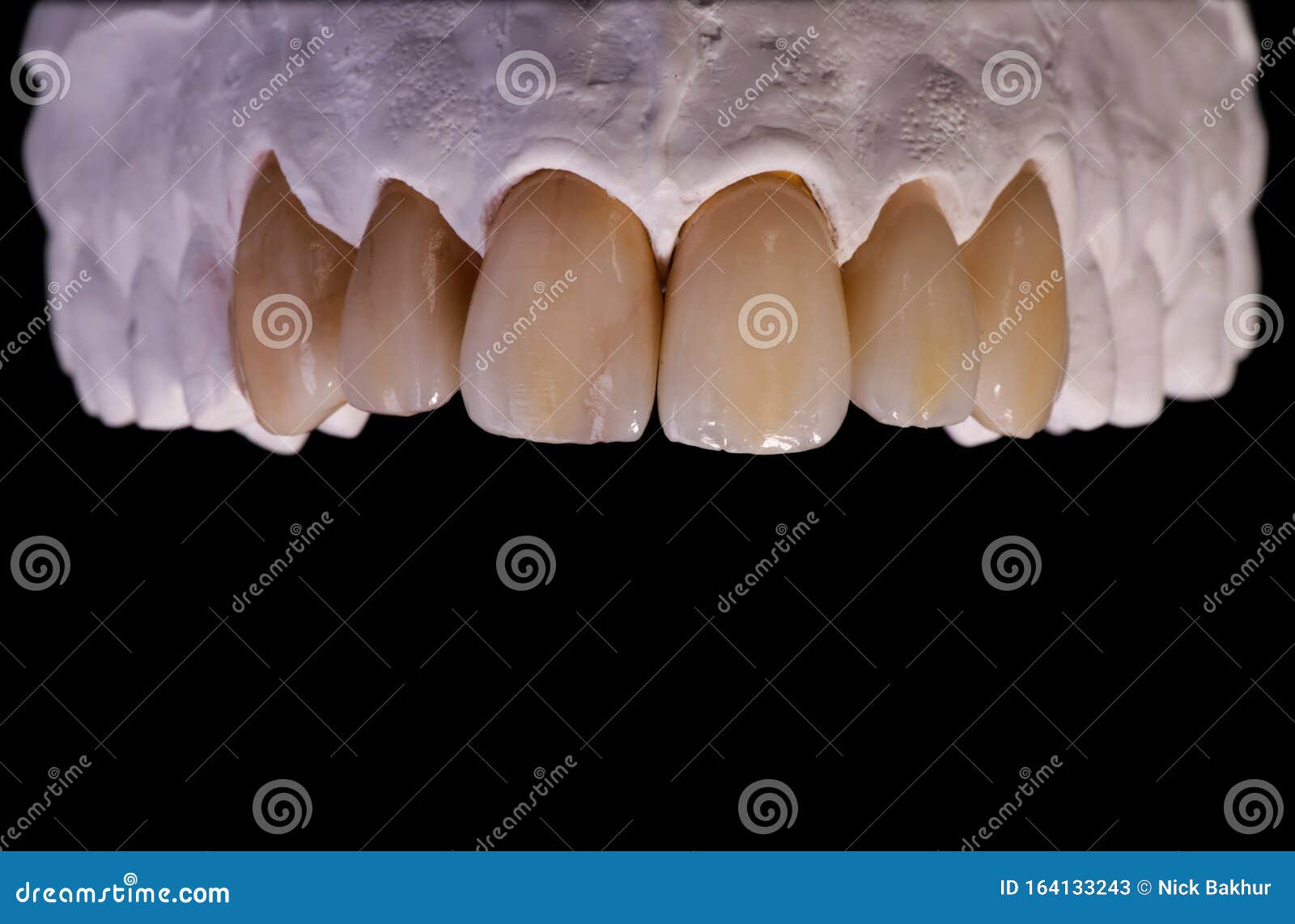 Dental Crowns. Close-up Ceramic Tooth Crown Stock Image - Image of ...