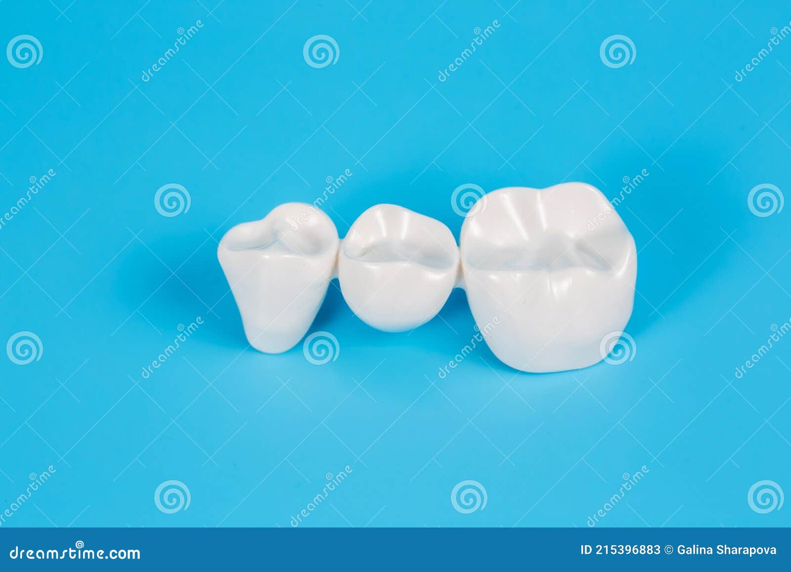 Dental Crowns, Imitation of a Dental Prosthesis of a Dental Bridge ...