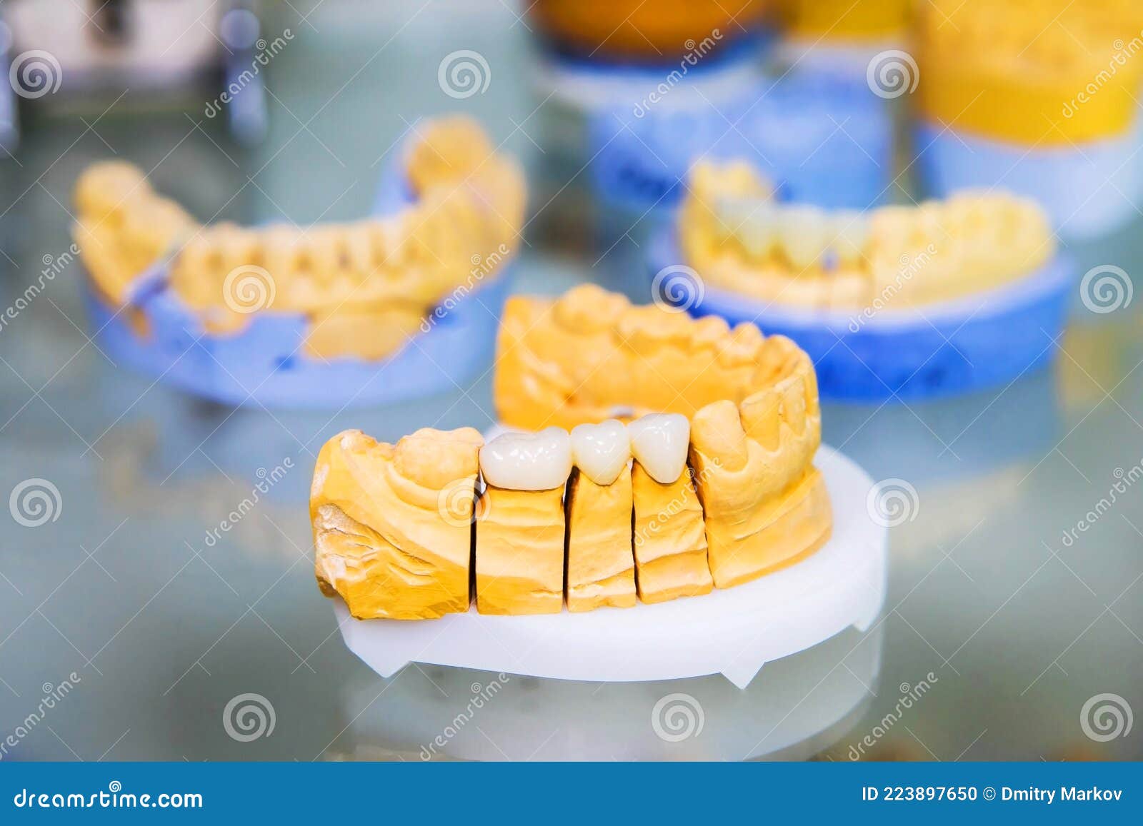 Model of Dentures. Manufacturing of Artificial Teeth in a Dental Clinic ...