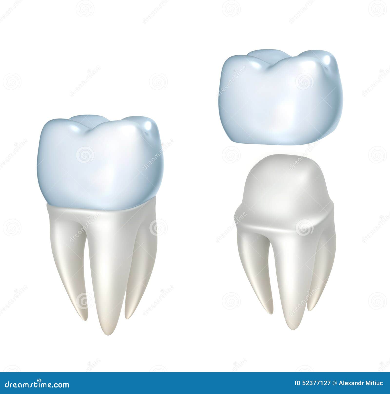 Dental Crowns and Tooth, Isolated on White Stock Illustration ...