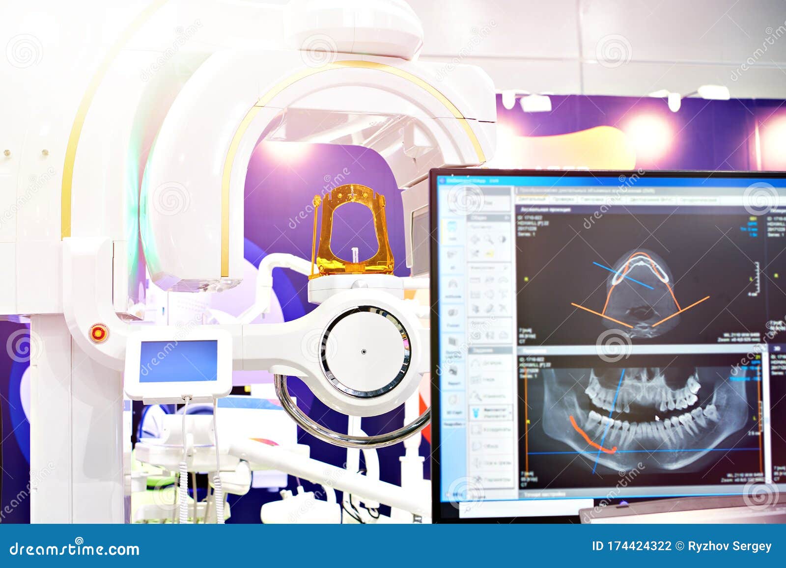 Dental digital tomograph stock photo. Image of indoor - 174424322