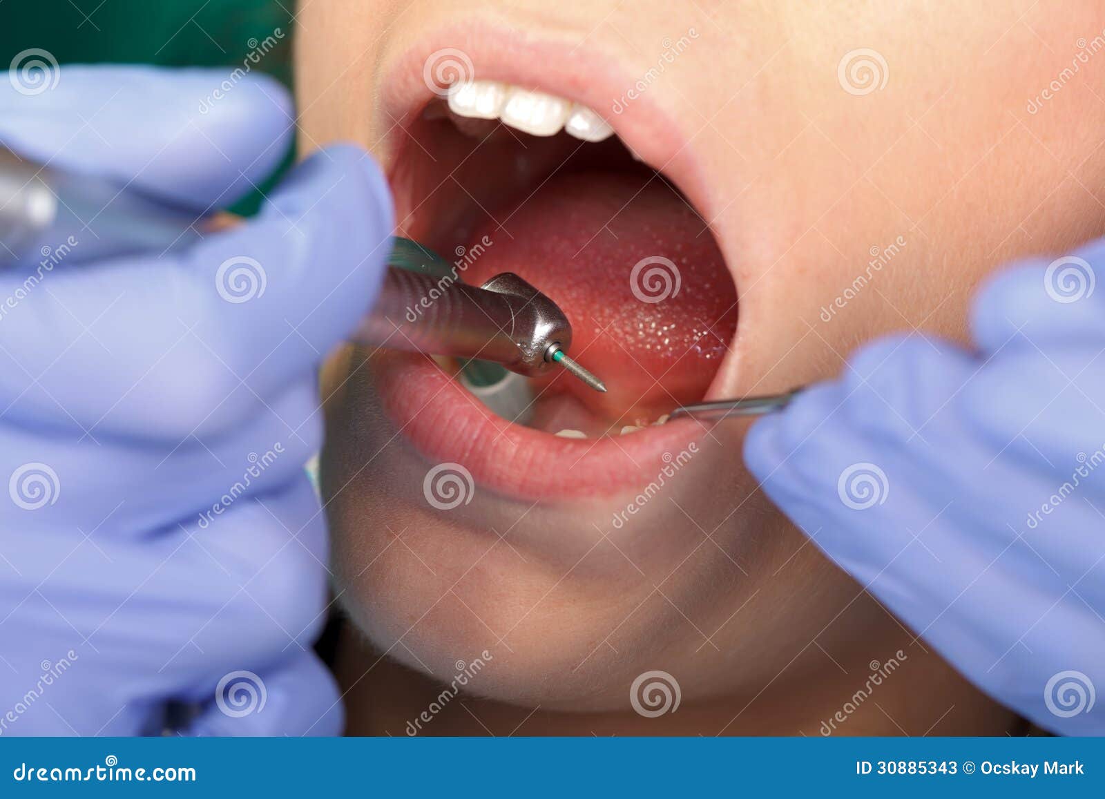 Dental drilling stock image. Image of oral, medical, healthy - 30885343