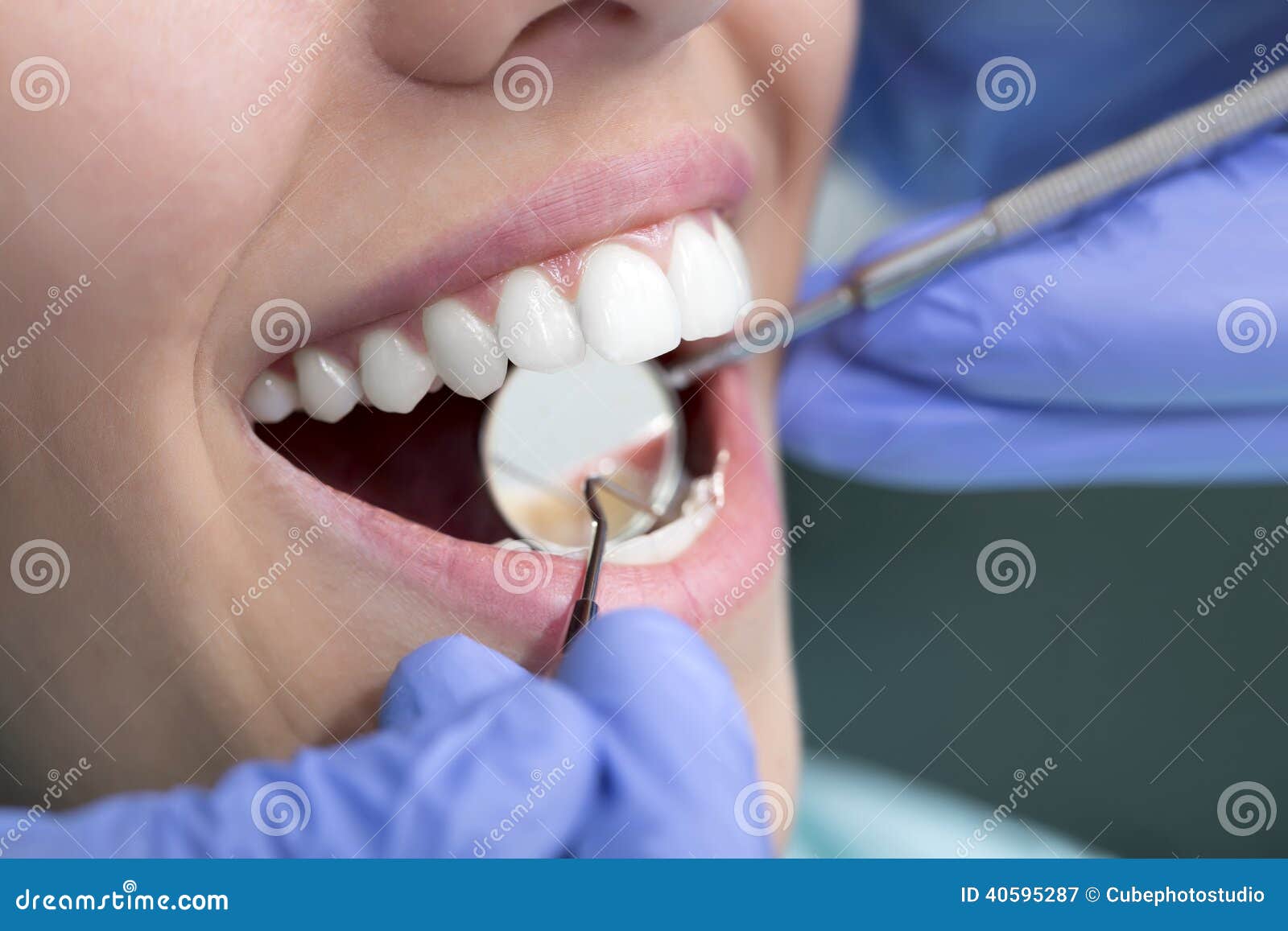 Dental Exam stock image. Image of glove, medical, open - 40595287